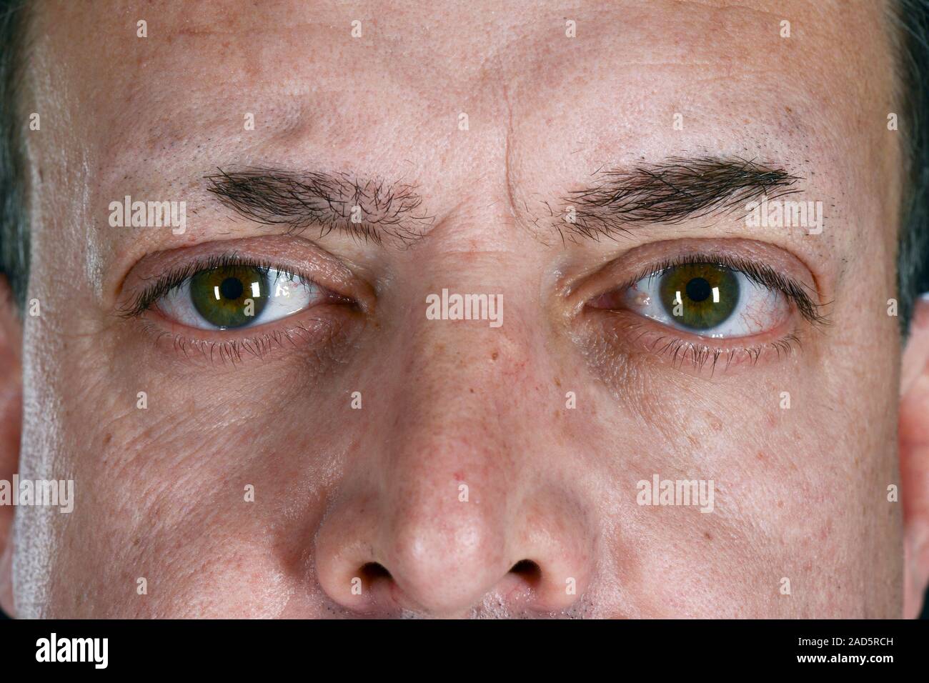 Positions of gaze, straight ahead. 50-year-old man demonstrating one of ...