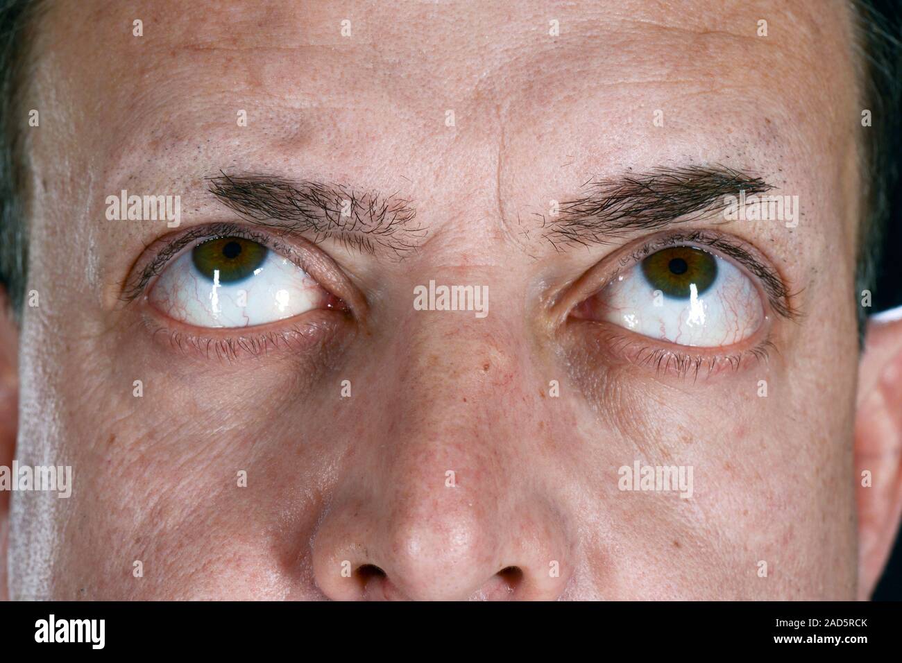 Positions of gaze, looking up. 50-year-old man demonstrating one of the ...