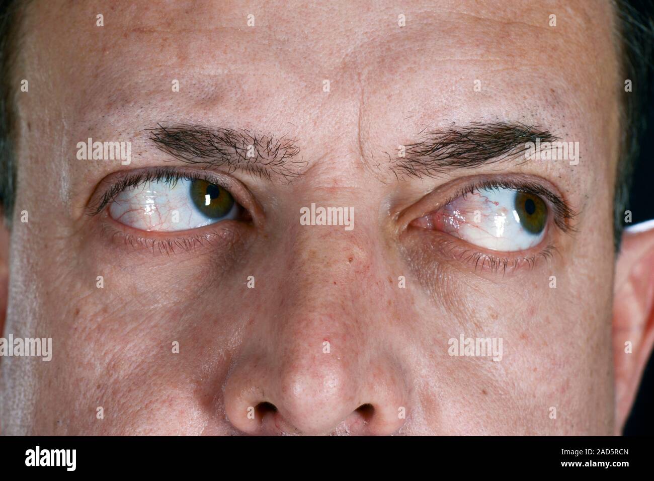 Positions of gaze, looking up and left. 50-year-old man demonstrating ...