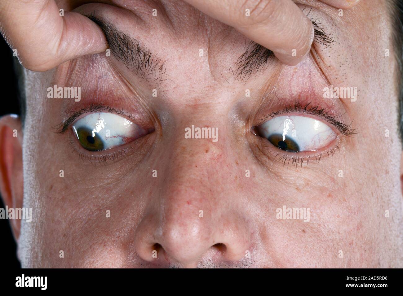 Positions of gaze, looking down and right. 50-year-old man ...