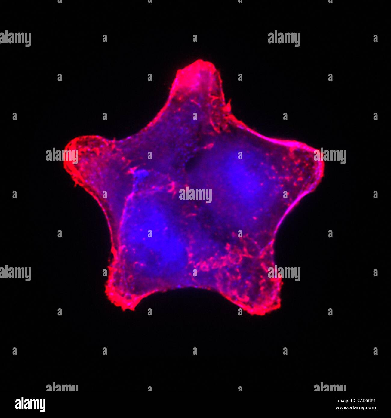 Cancer cell labelling research. This cancer cell has formed a star ...