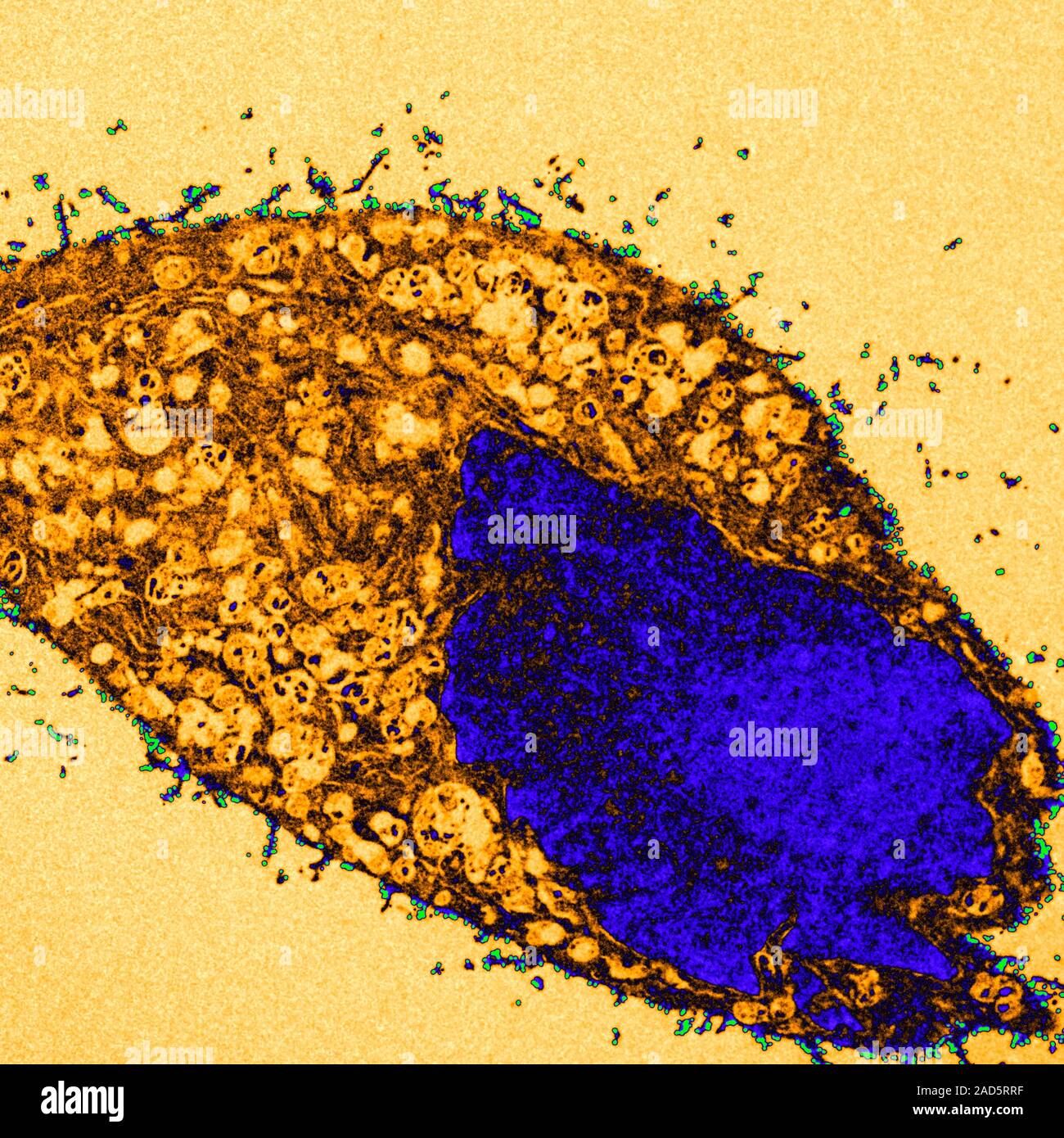 Quantum dots cancer imaging research. Coloured transmission electron ...