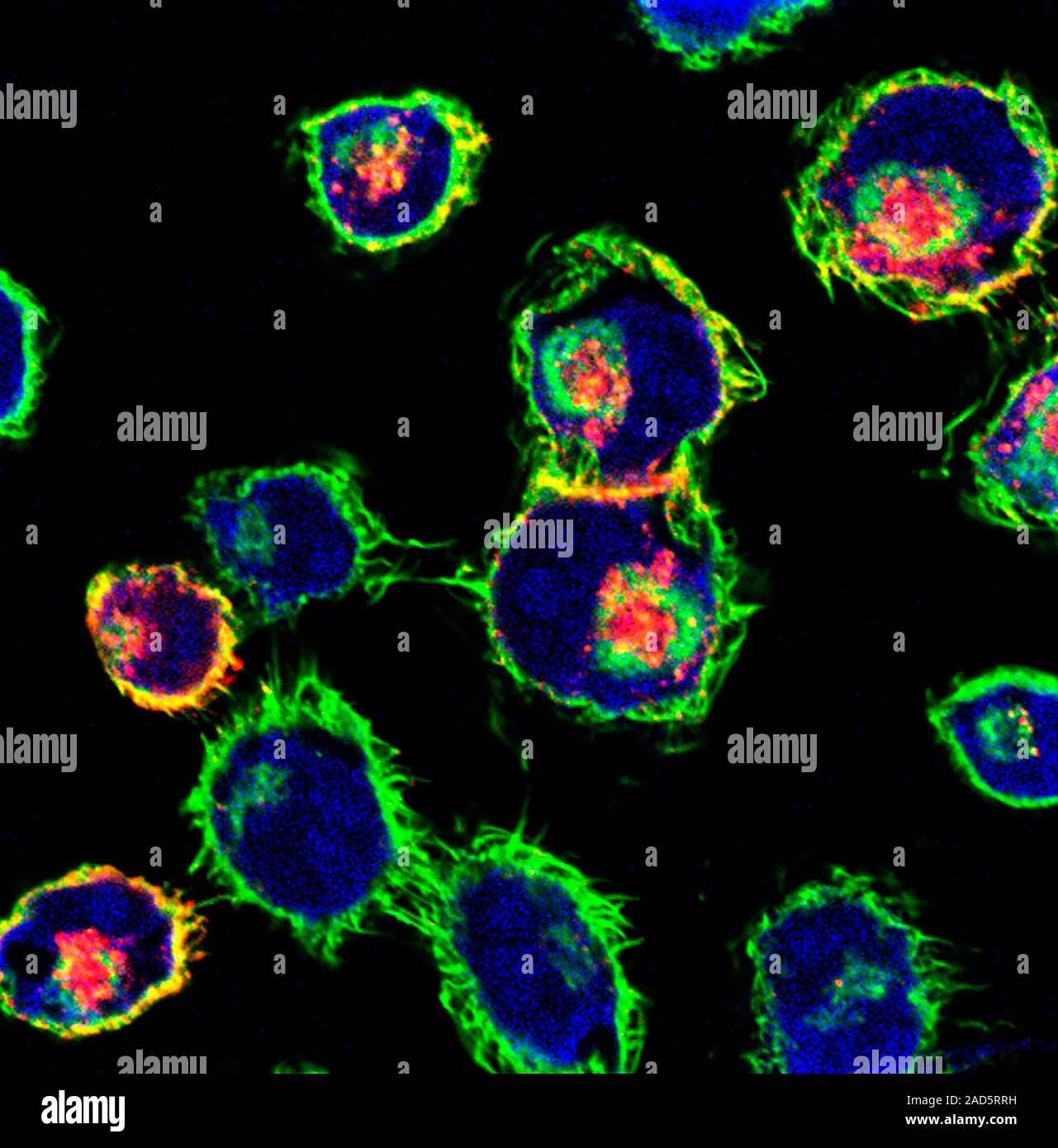 RNA nanotechnology cancer treatment. Fluorescence light micrograph ...