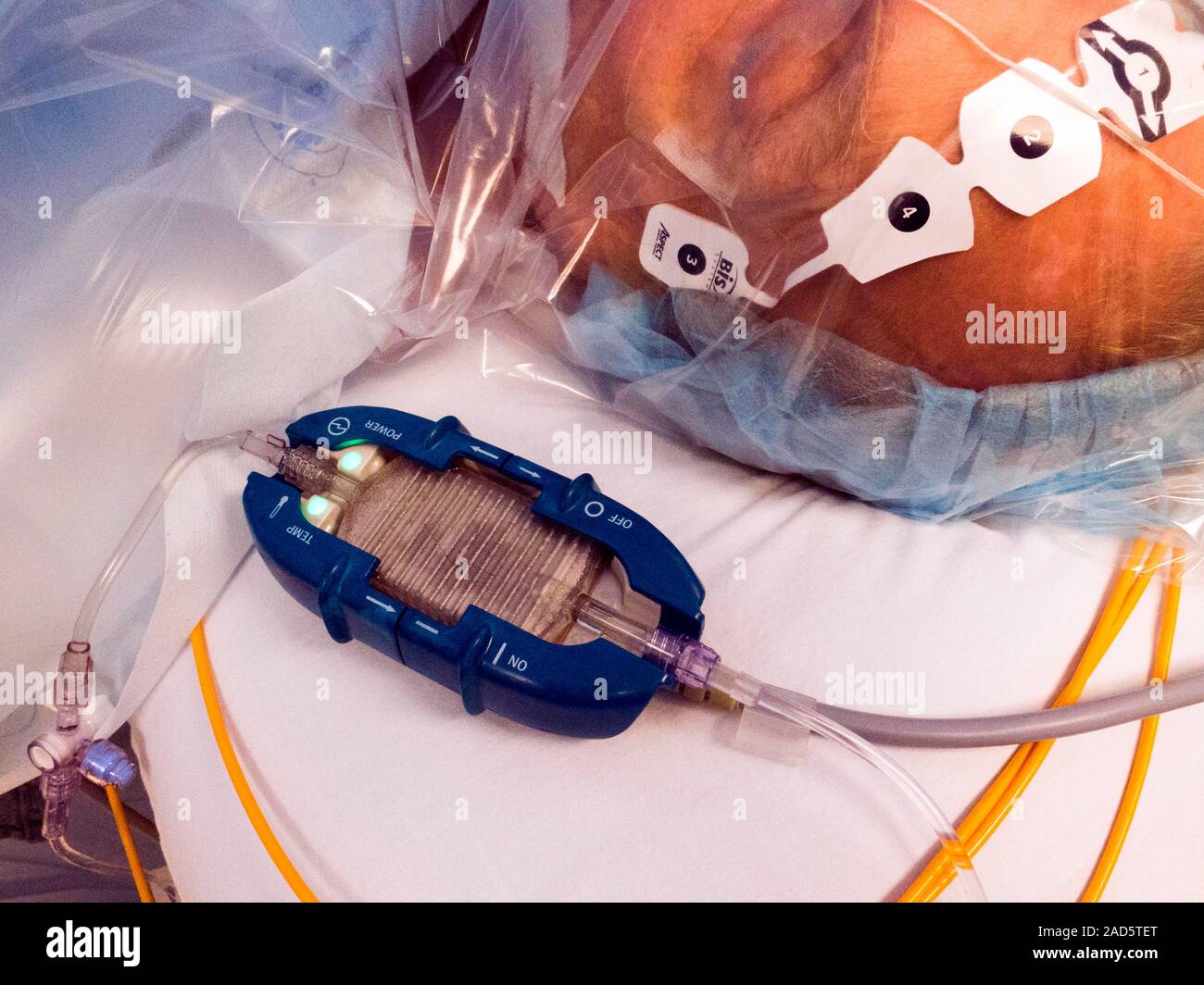 Intravenous fluid warmer in the operating room. Close-up of a device ...