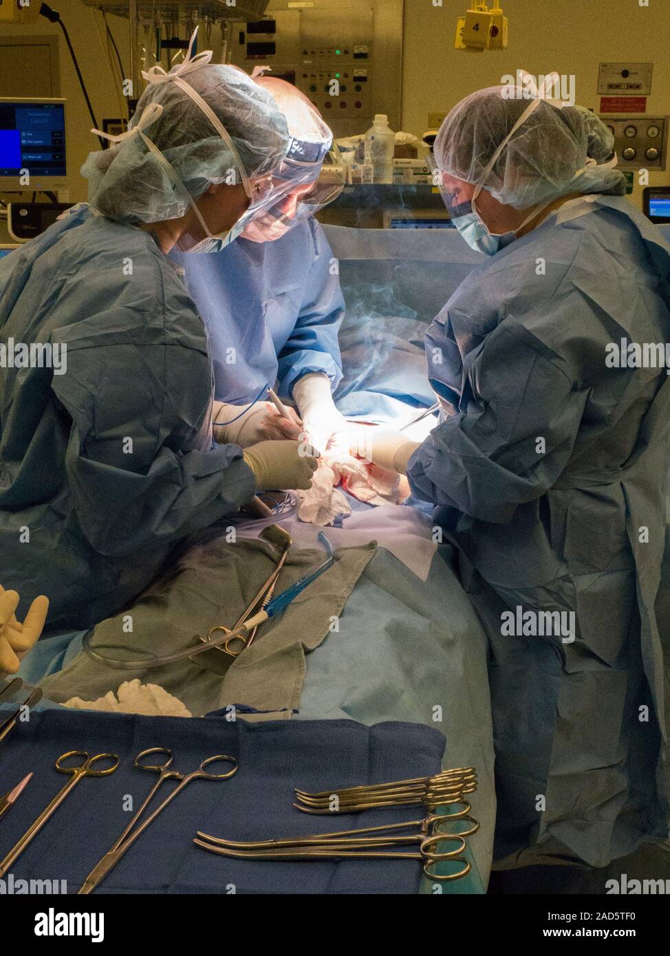 Surgeons at work. Surgical team operating on a patient Stock Photo - Alamy