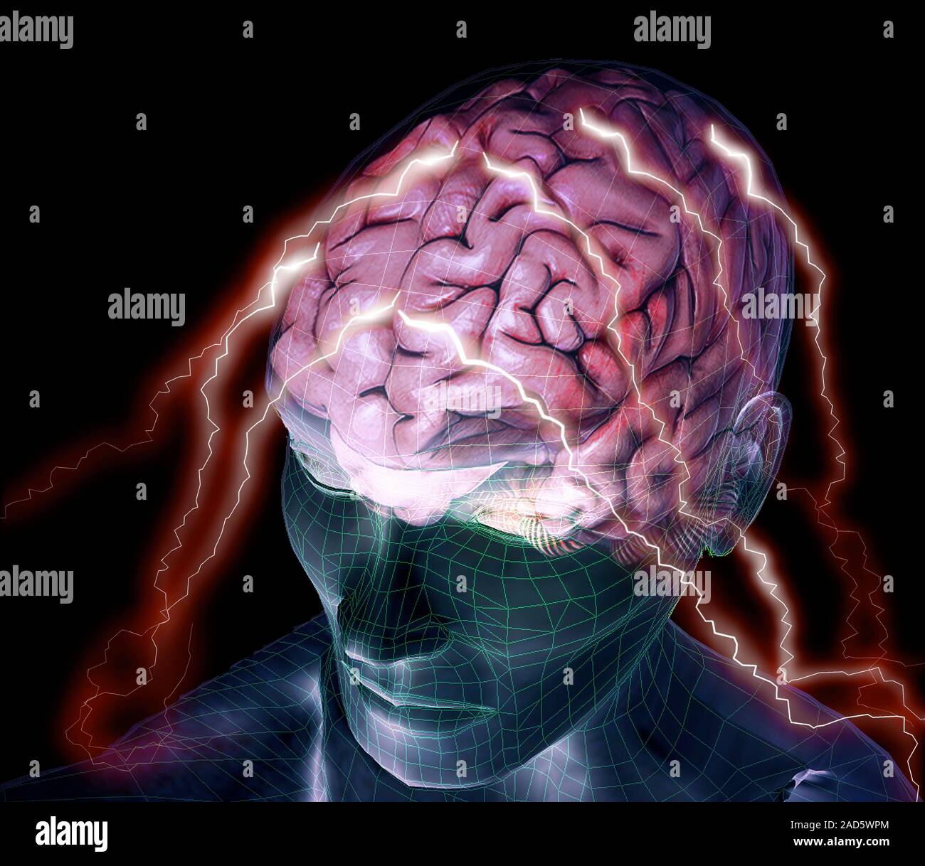 Migraine. Conceptual image of a 3D brain magnetic resonance imaging ...