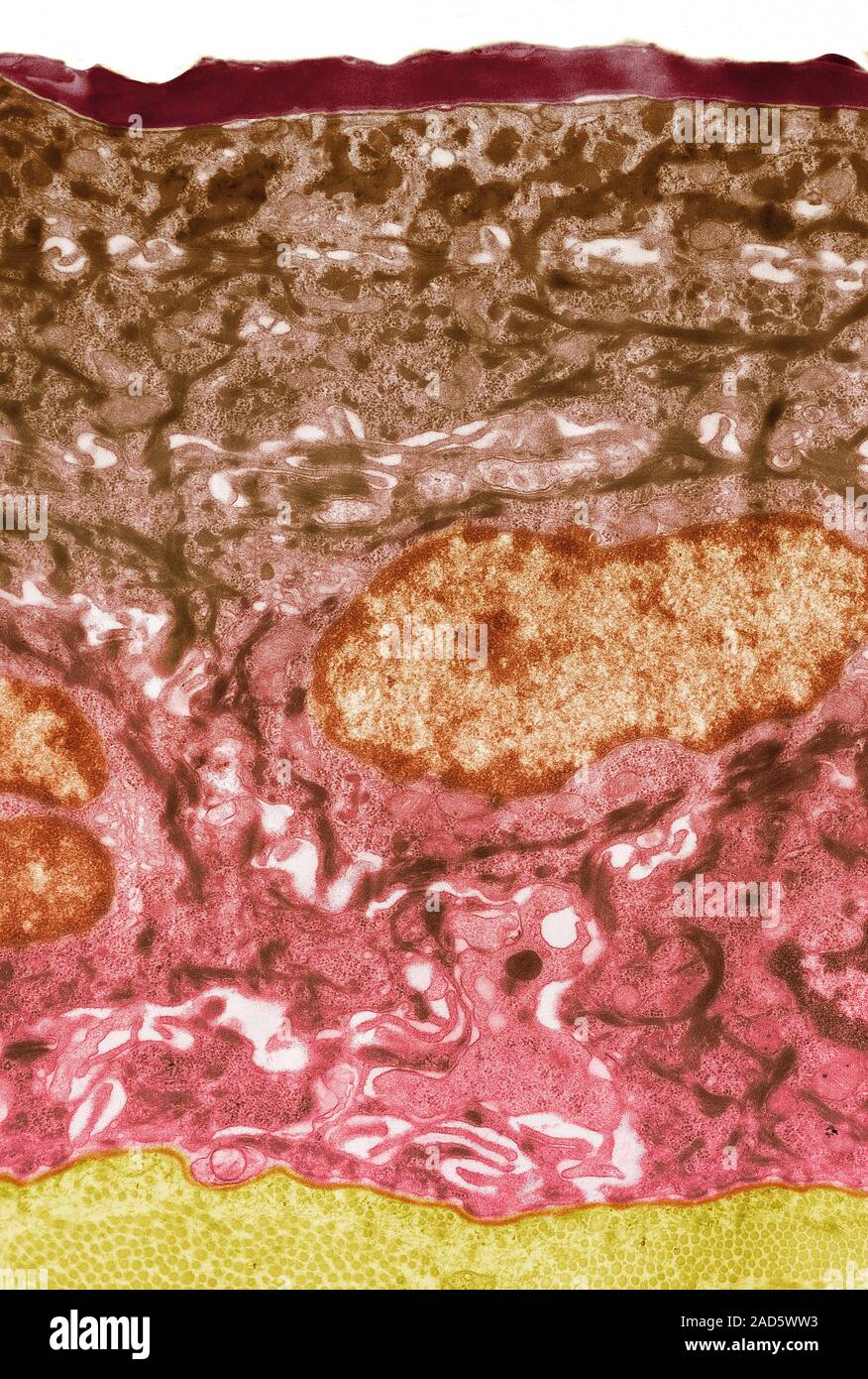 Skin section. Coloured transmission electron micrograph (TEM) of a ...