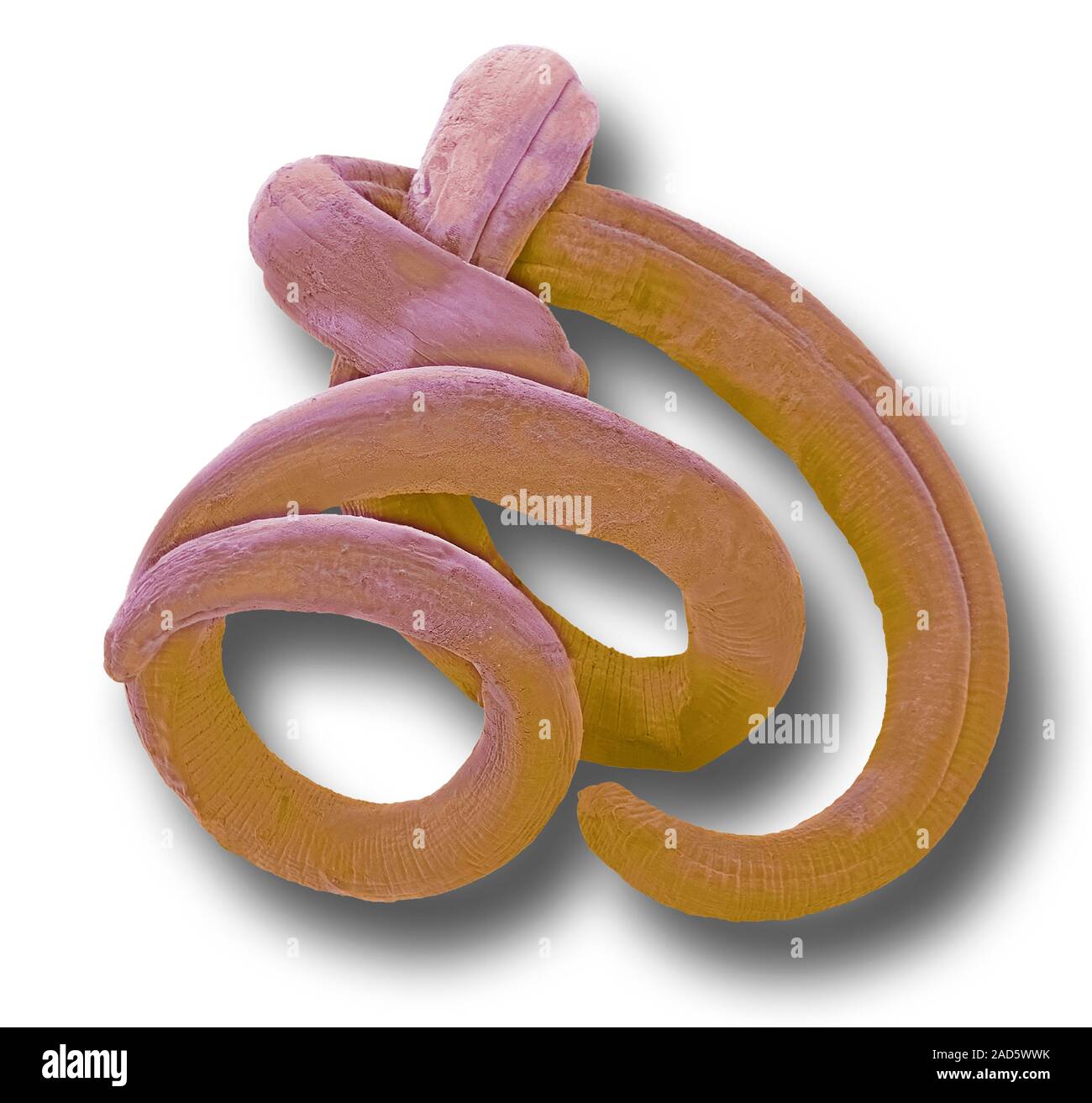 Threadworm, coloured scanning electron micrograph (SEM). This is a ...