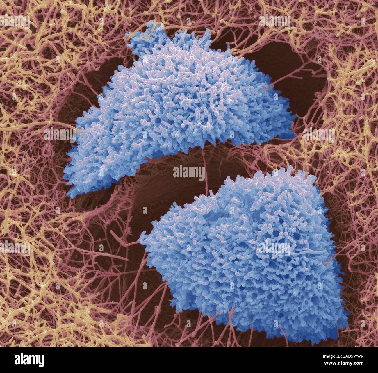 Hyaline cartilage. Coloured scanning electron micrograph (SEM) of a ...