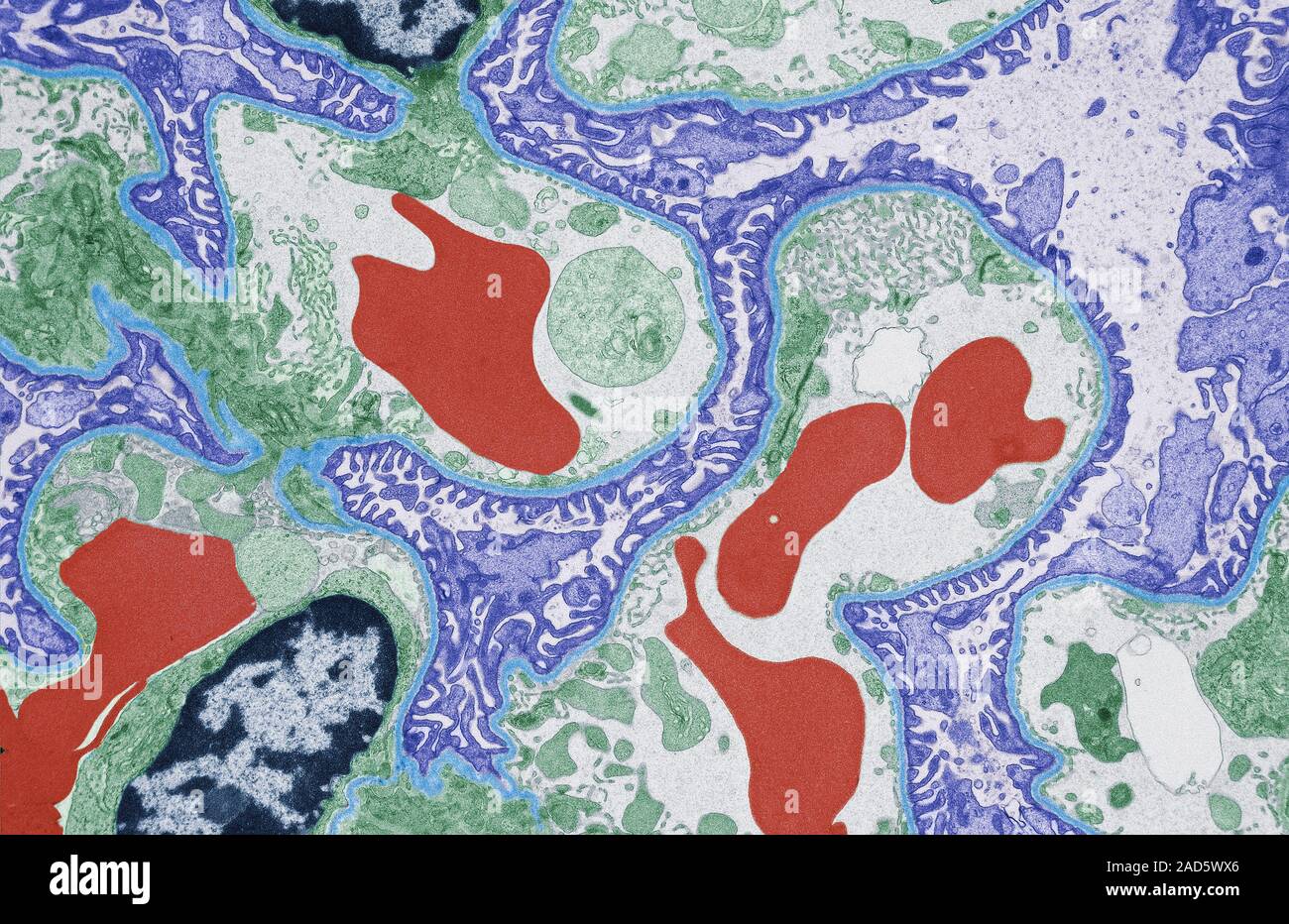 Glomerulus. Coloured transmission electron micrograph (TEM) of a ...