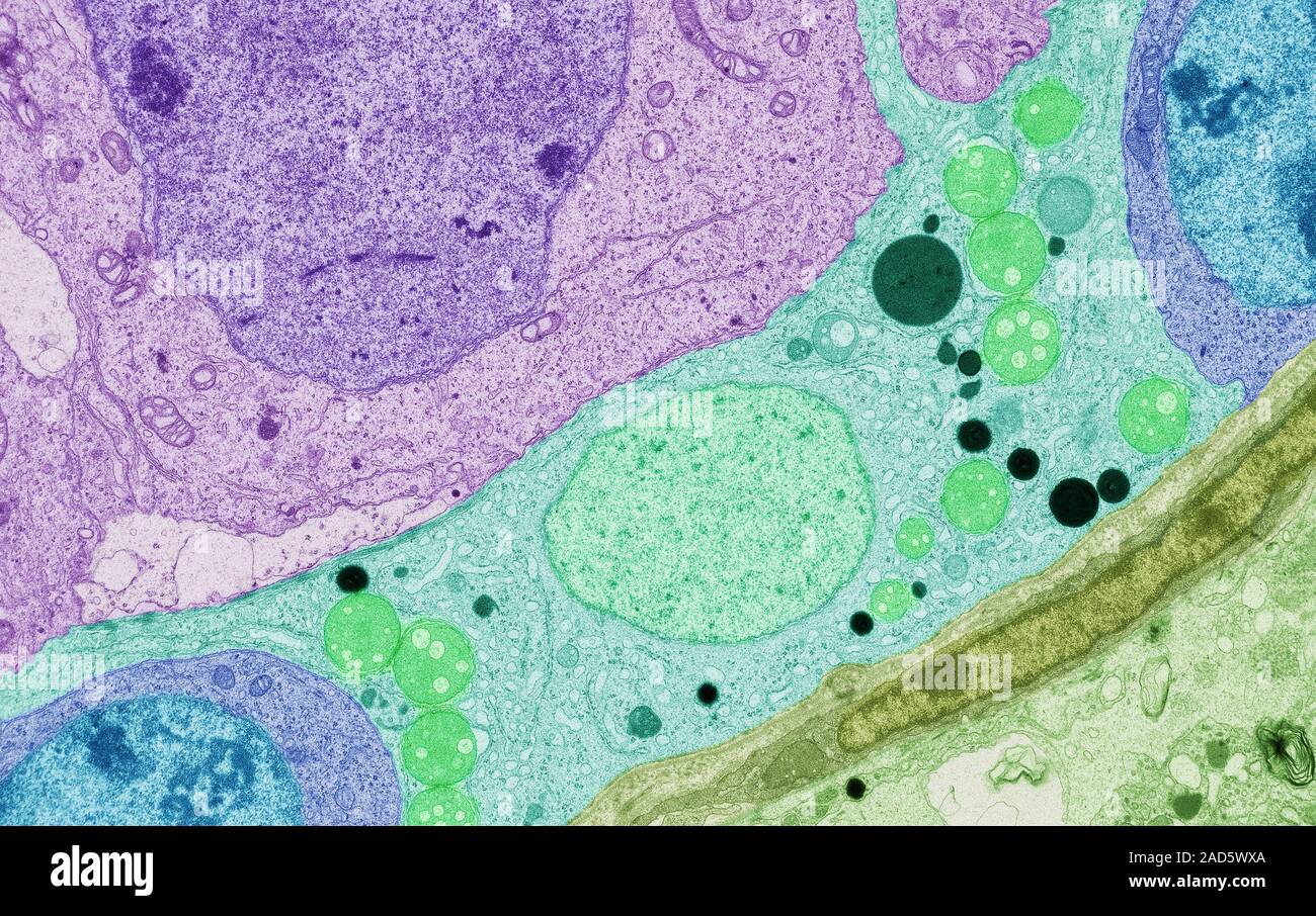 Sertoli Cells Coloured Transmission Electron Micrograph Tem Of