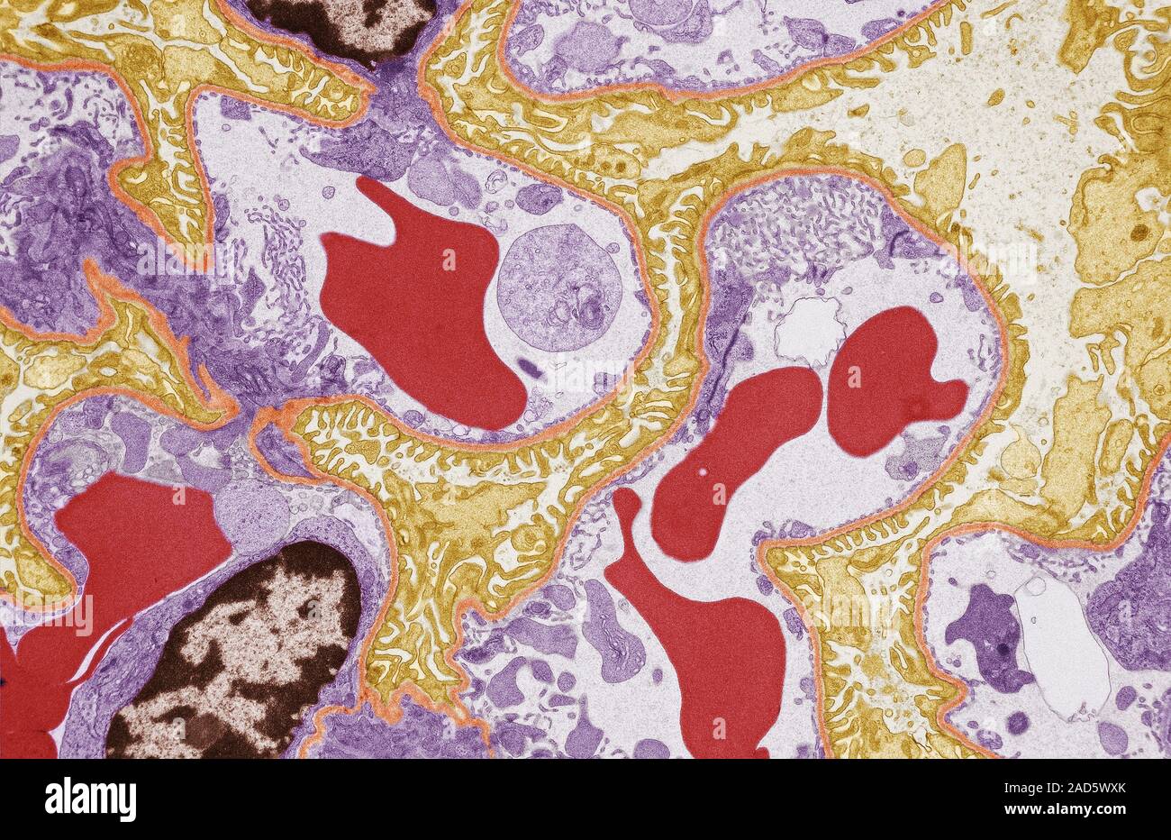 Glomerulus. Coloured transmission electron micrograph (TEM) of a ...