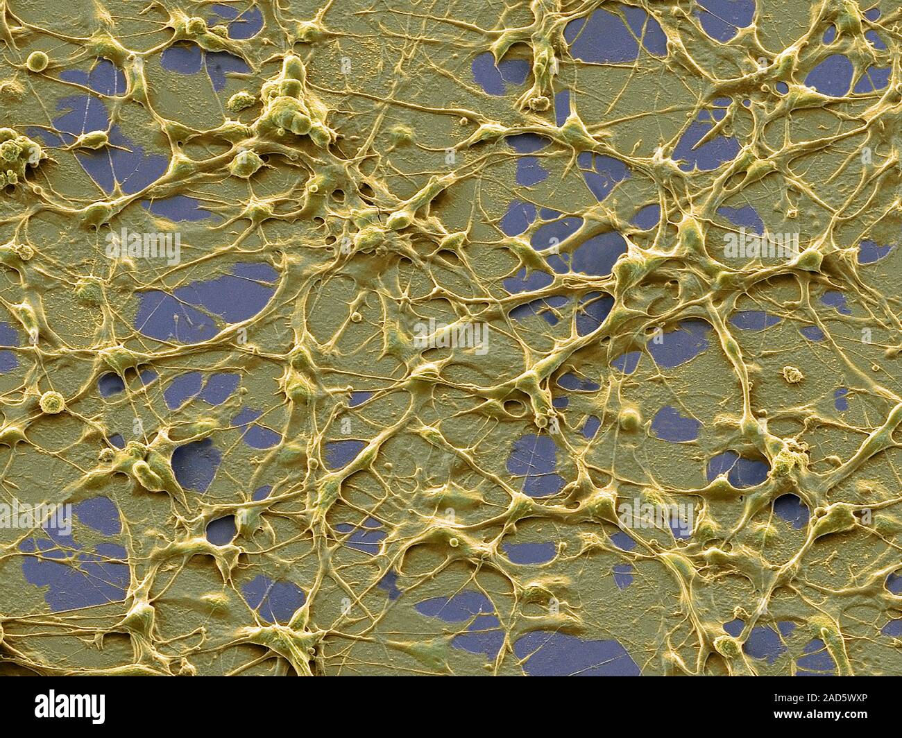 Neurones. Coloured scanning electron micrograph (SEM) of nerve cells ...