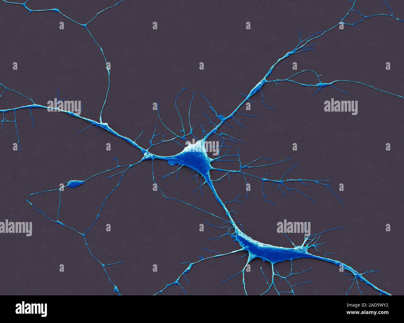 Neurones. Coloured scanning electron micrograph (SEM) of nerve cells ...