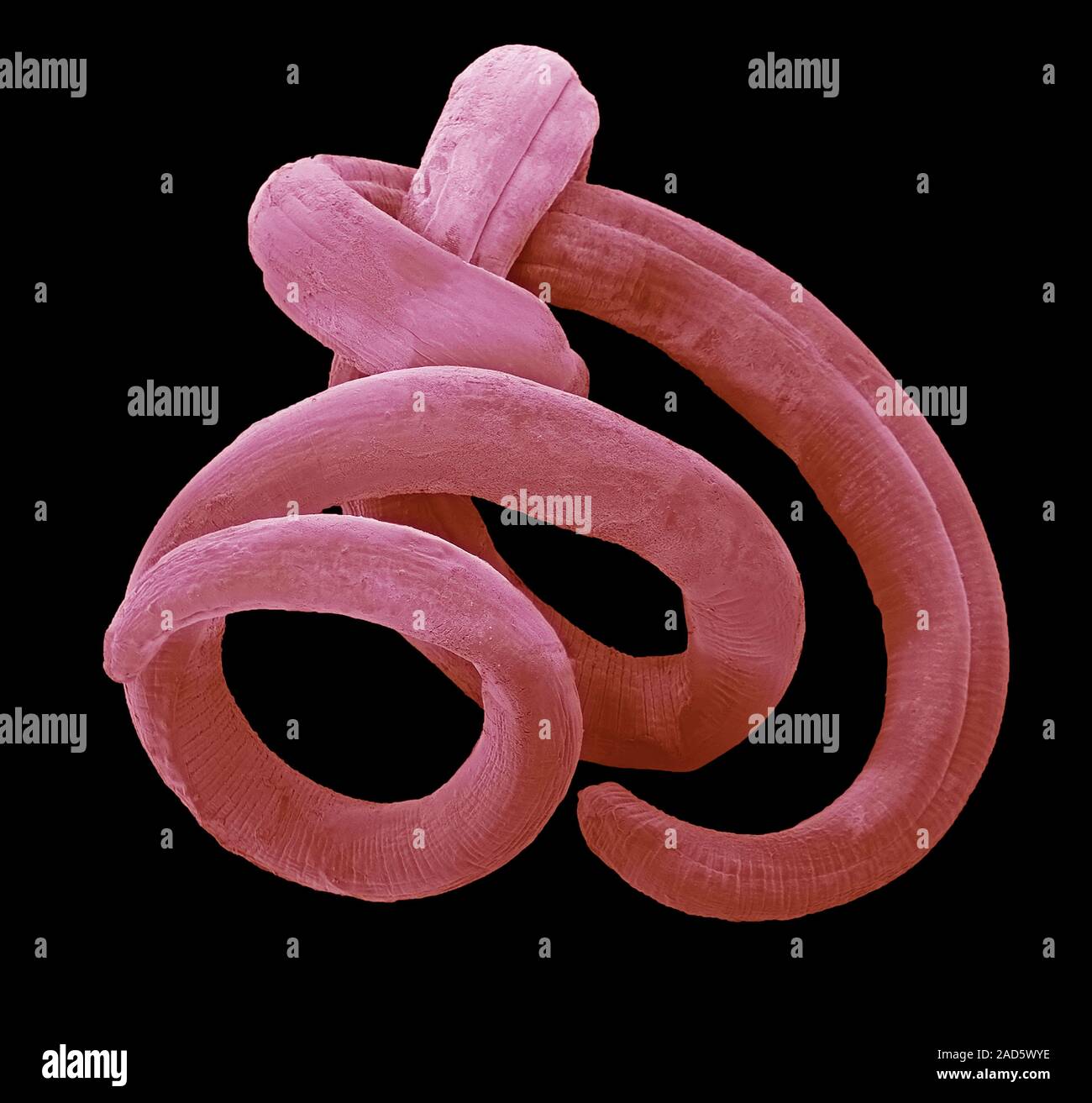 Threadworm, coloured scanning electron micrograph (SEM). This is a ...