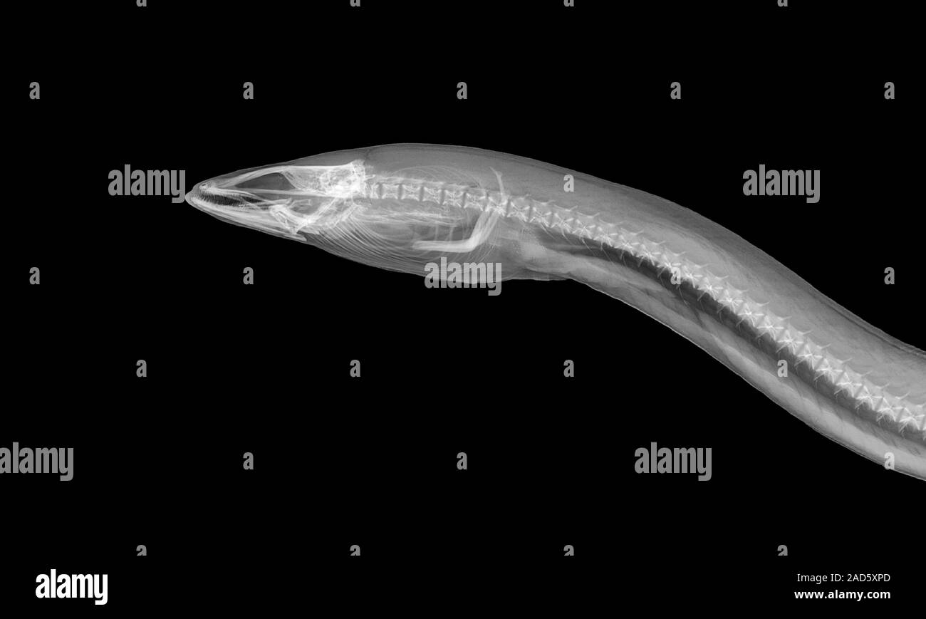 Eel (Order Anguilliformes), X-ray Stock Photo - Alamy