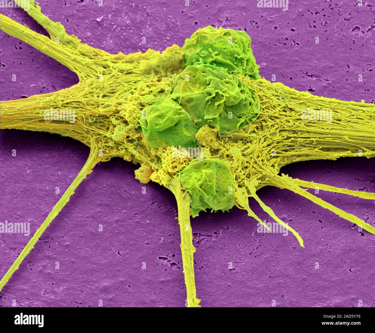 Stem cell-derived neuron. Coloured scanning electron micrograph (SEM ...