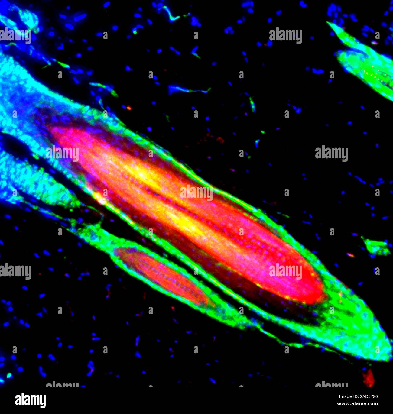 Hair root in skin, fluorescence light micrograph. The root, embedded in ...