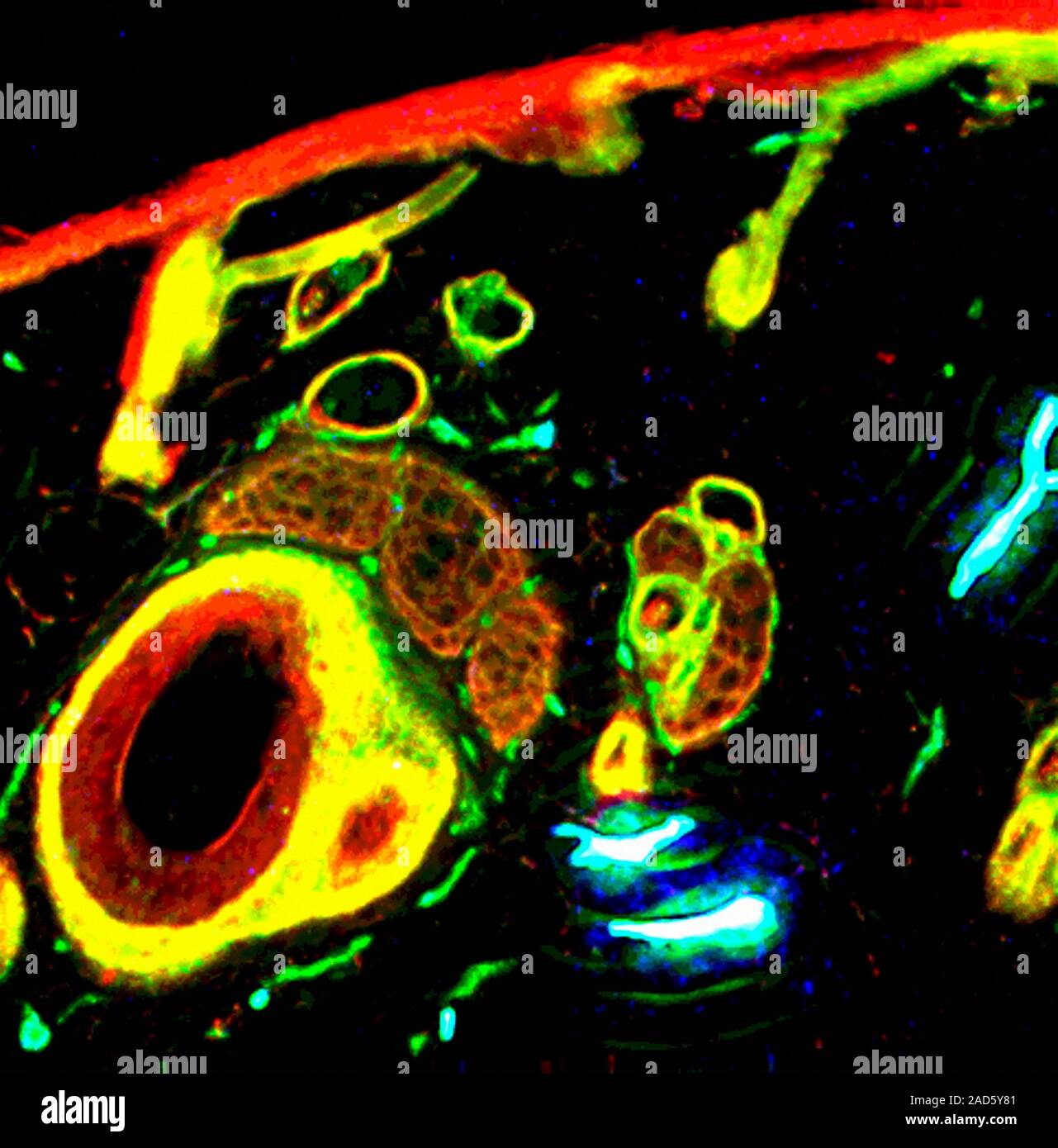 Sebaceous glands, fluorescence light micrograph. These glands produce ...