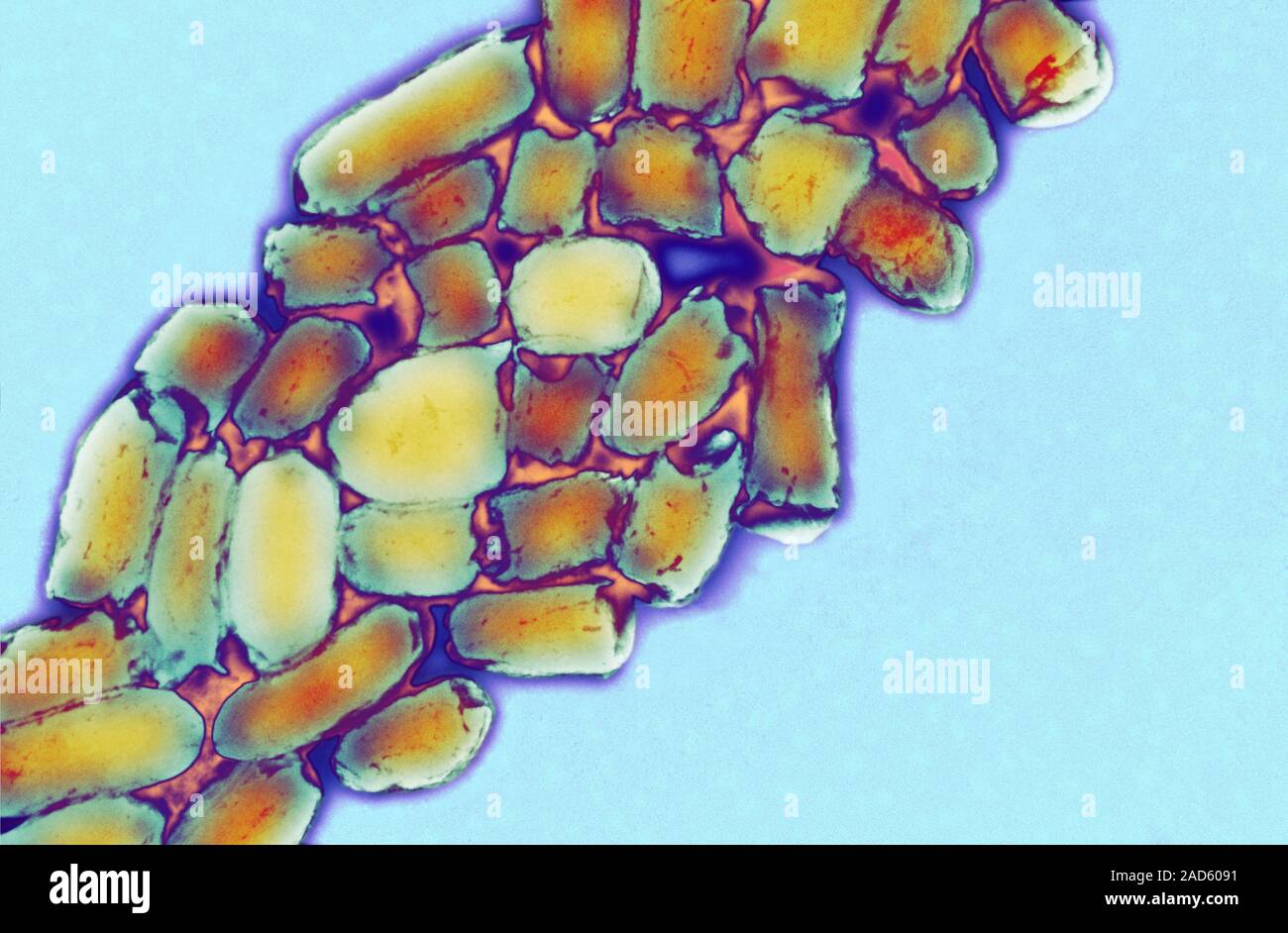 Coloured transmission electron micrograph (TEM) of Escherichia coli ...