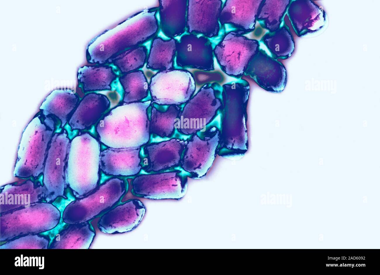 Coloured transmission electron micrograph (TEM) of Escherichia coli ...