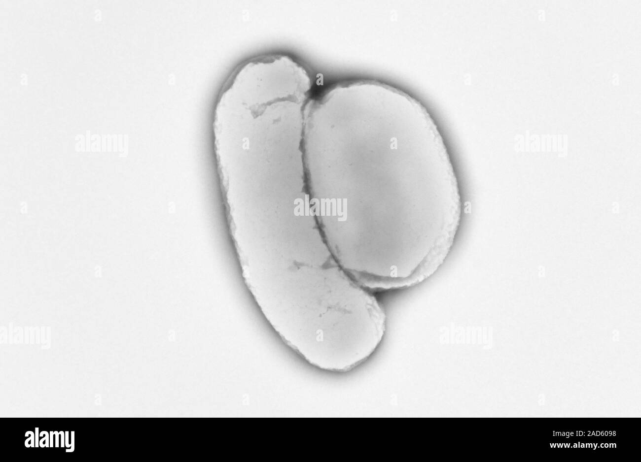 Transmission electron micrograph (TEM) of Escherichia coli O157 ...