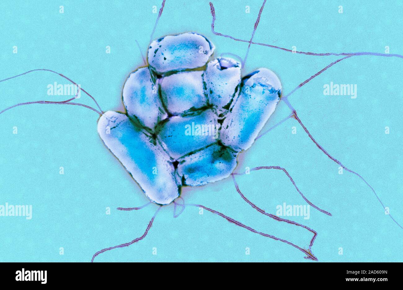 Coloured transmission electron micrograph (TEM) of Escherichia coli ...