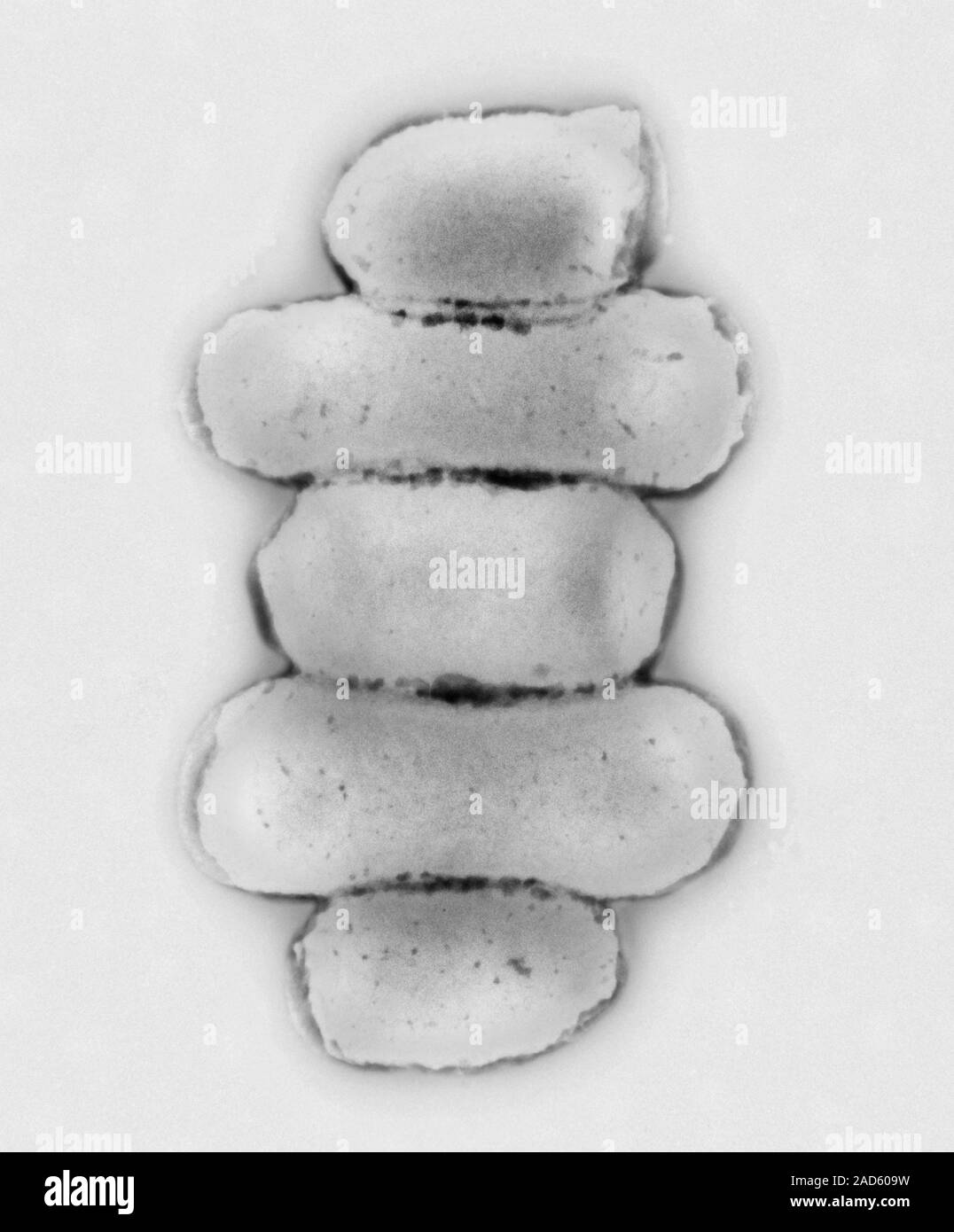 Transmission electron micrograph (TEM) of Escherichia coli O157 ...