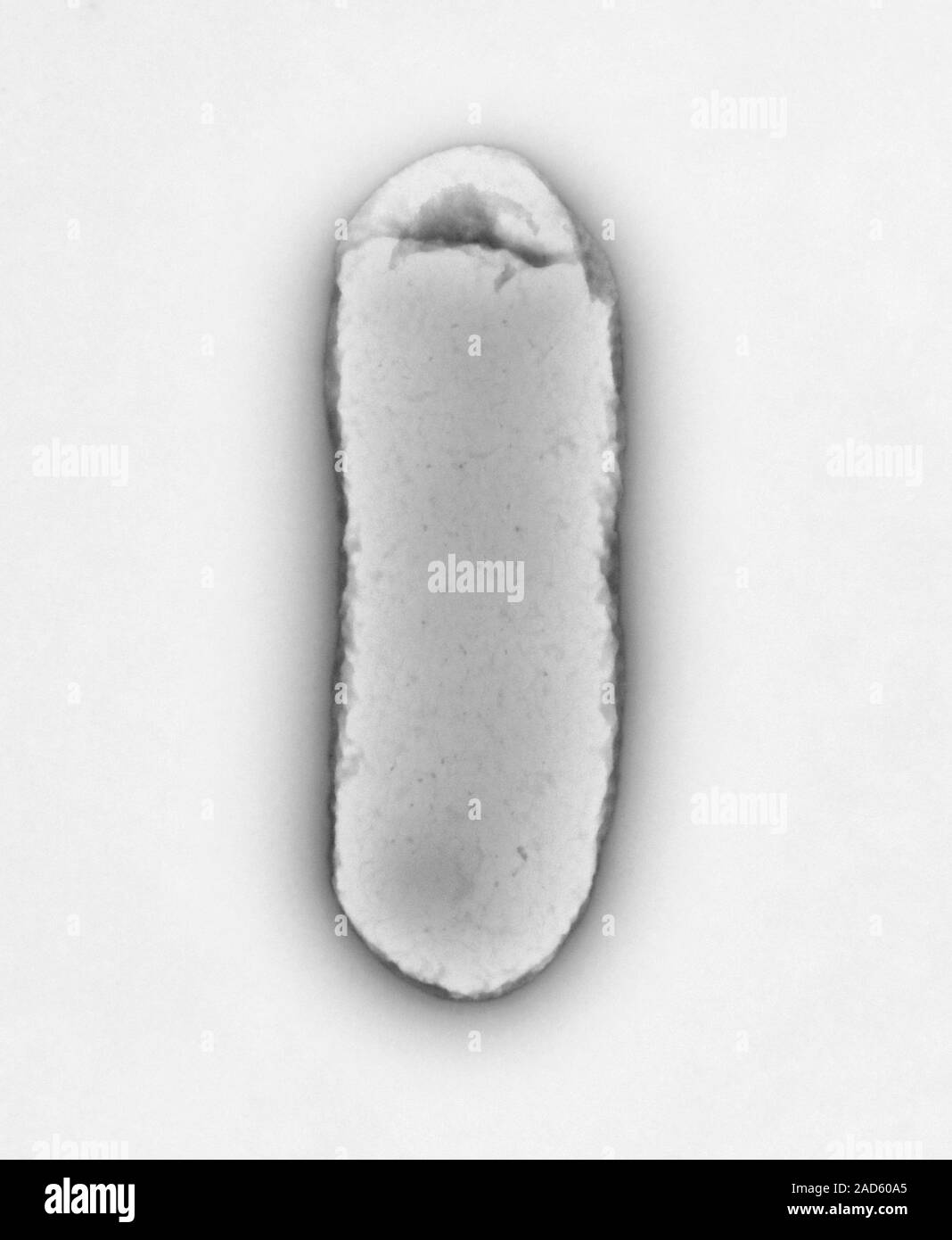 Transmission electron micrograph (TEM) of an Escherichia coli O157 ...
