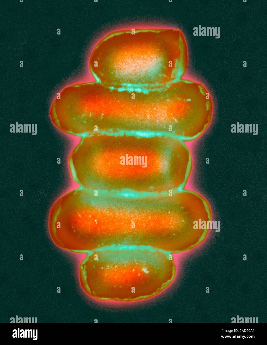 Coloured transmission electron micrograph (TEM) of Escherichia coli ...