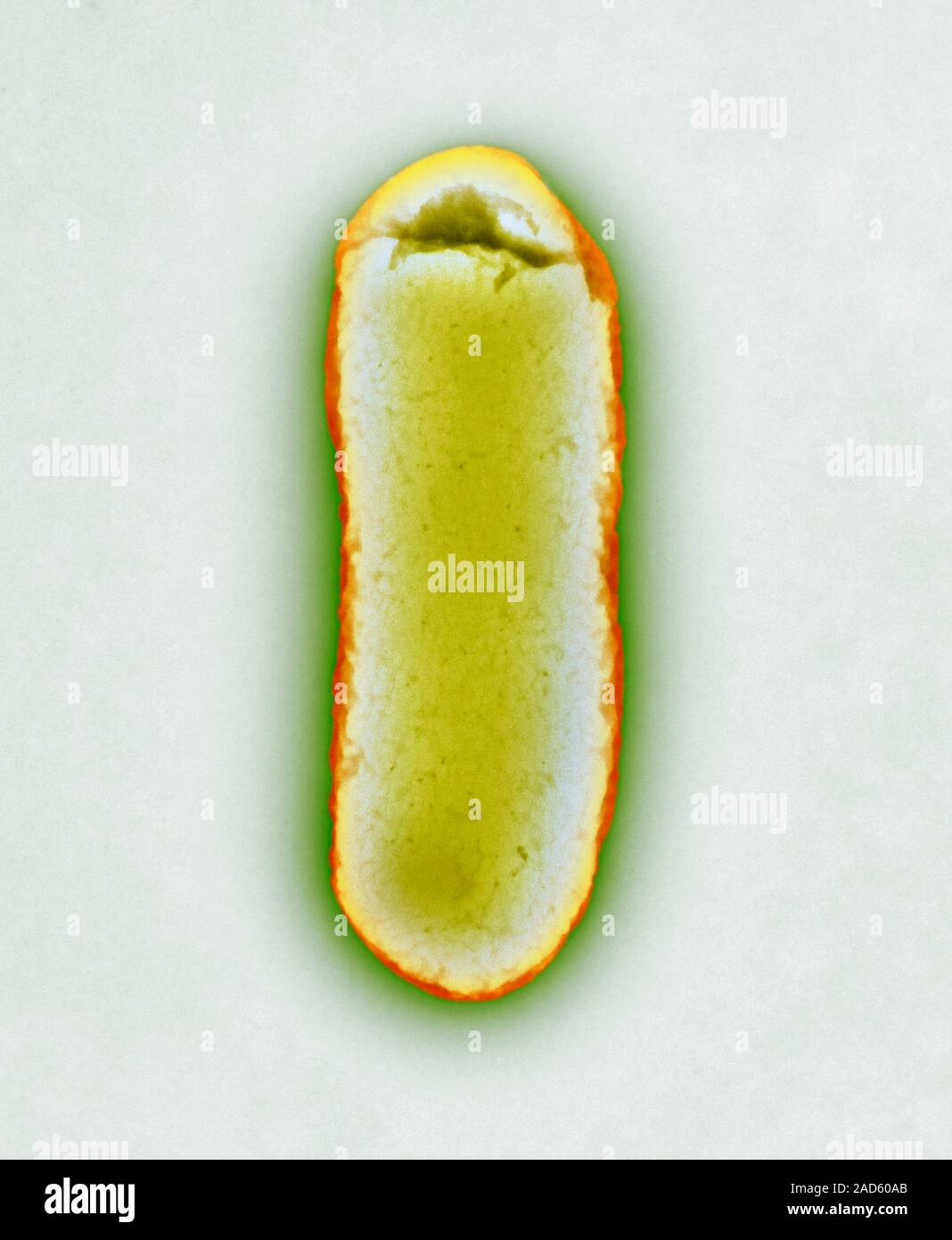Coloured transmission electron micrograph (TEM) of an Escherichia coli ...