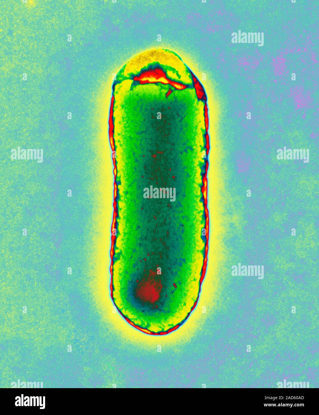 Coloured transmission electron micrograph (TEM) of an Escherichia coli ...
