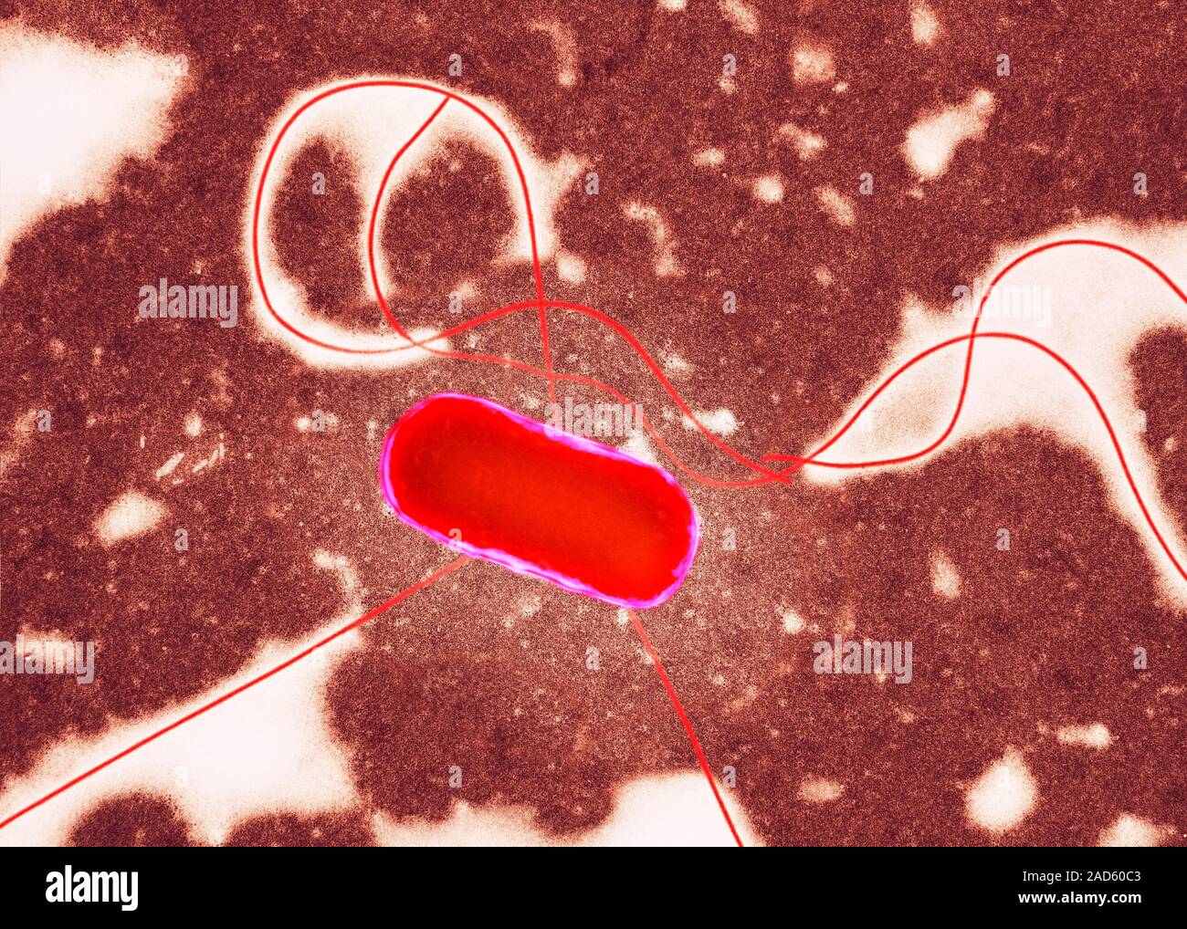 Coloured transmission electron micrograph (TEM) of an Escherichia coli ...