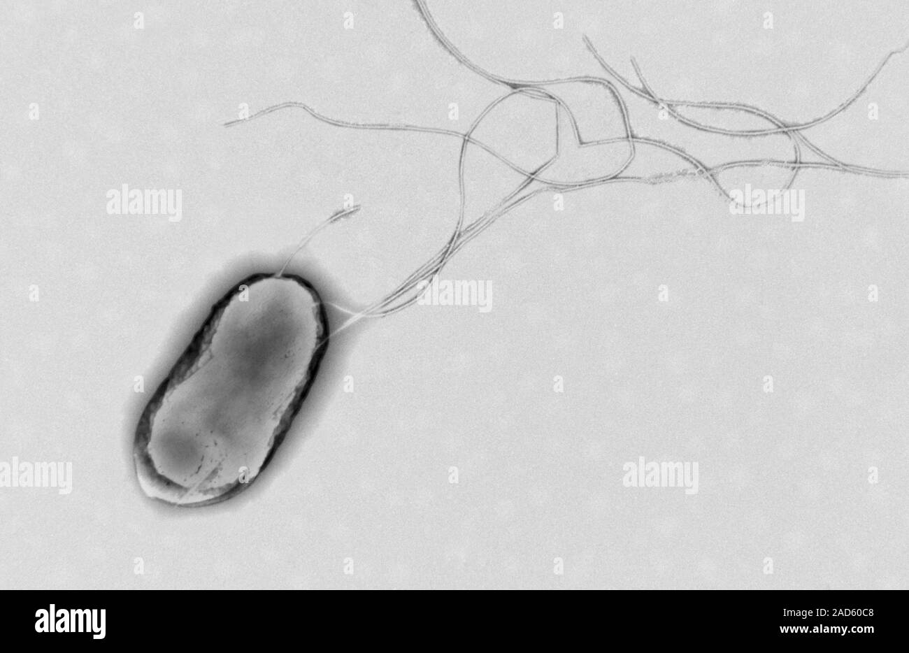 Transmission electron micrograph (TEM) of an Escherichia coli O157 ...