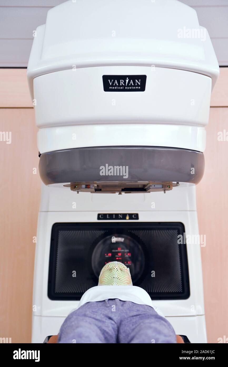 Brain cancer radiotherapy. 70-year-old woman with a malignant brain ...