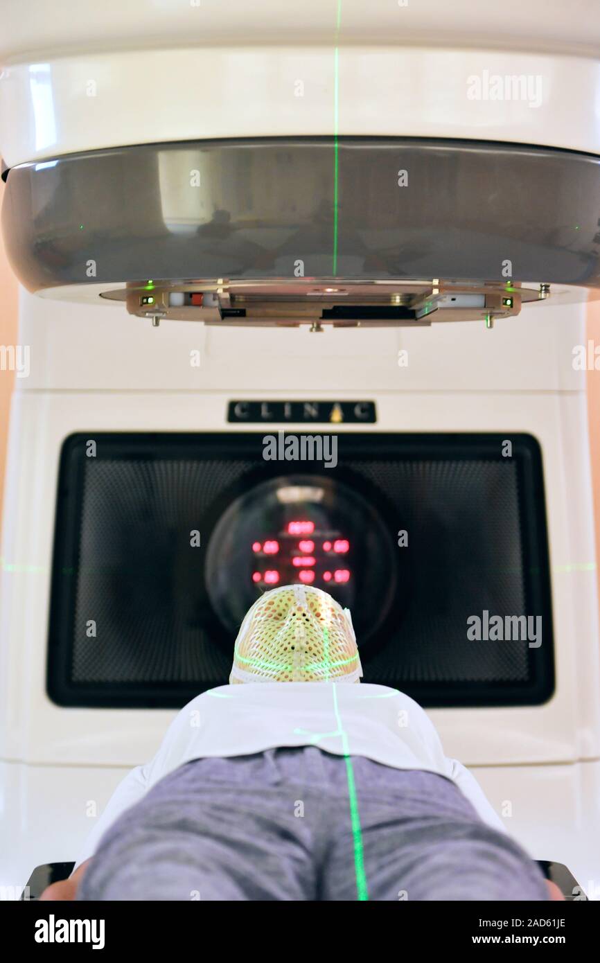 Brain cancer radiotherapy. 70-year-old woman with a malignant brain ...