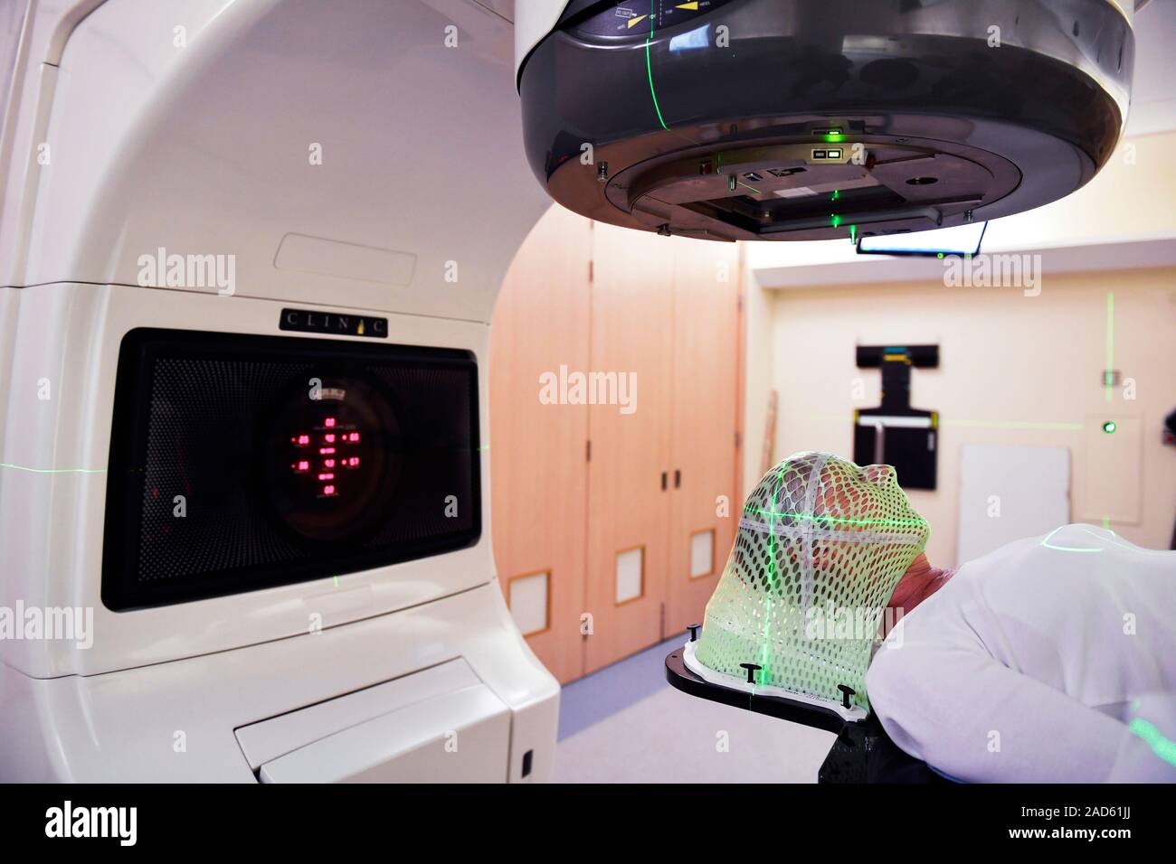 Brain cancer radiotherapy. 70-year-old woman with a malignant brain ...