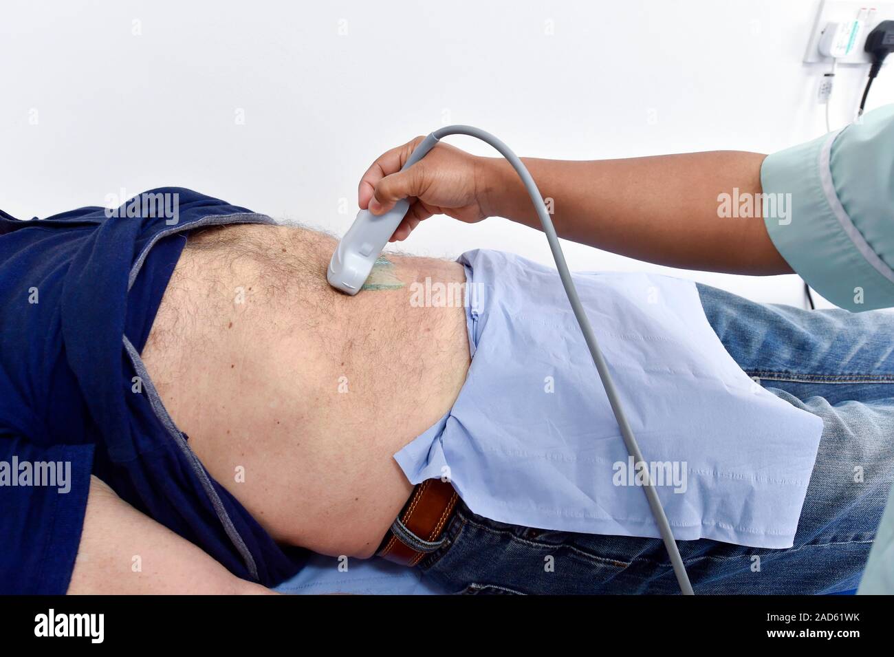 Ultrasound screening for abdominal aortic aneurysm. Ultrasound ...