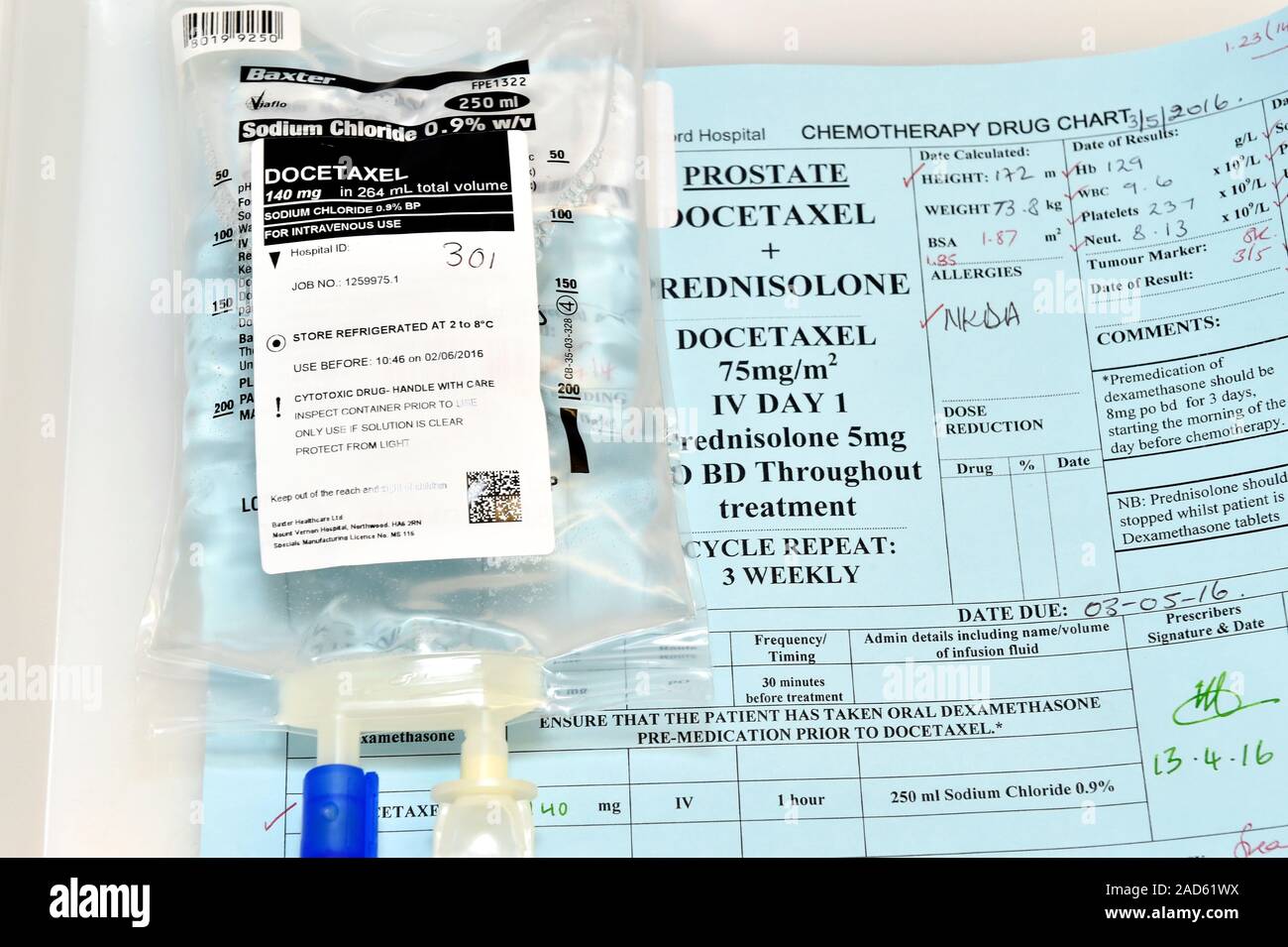 Prostate cancer chemotherapy drug. Intravenous drip bag and hospital ...