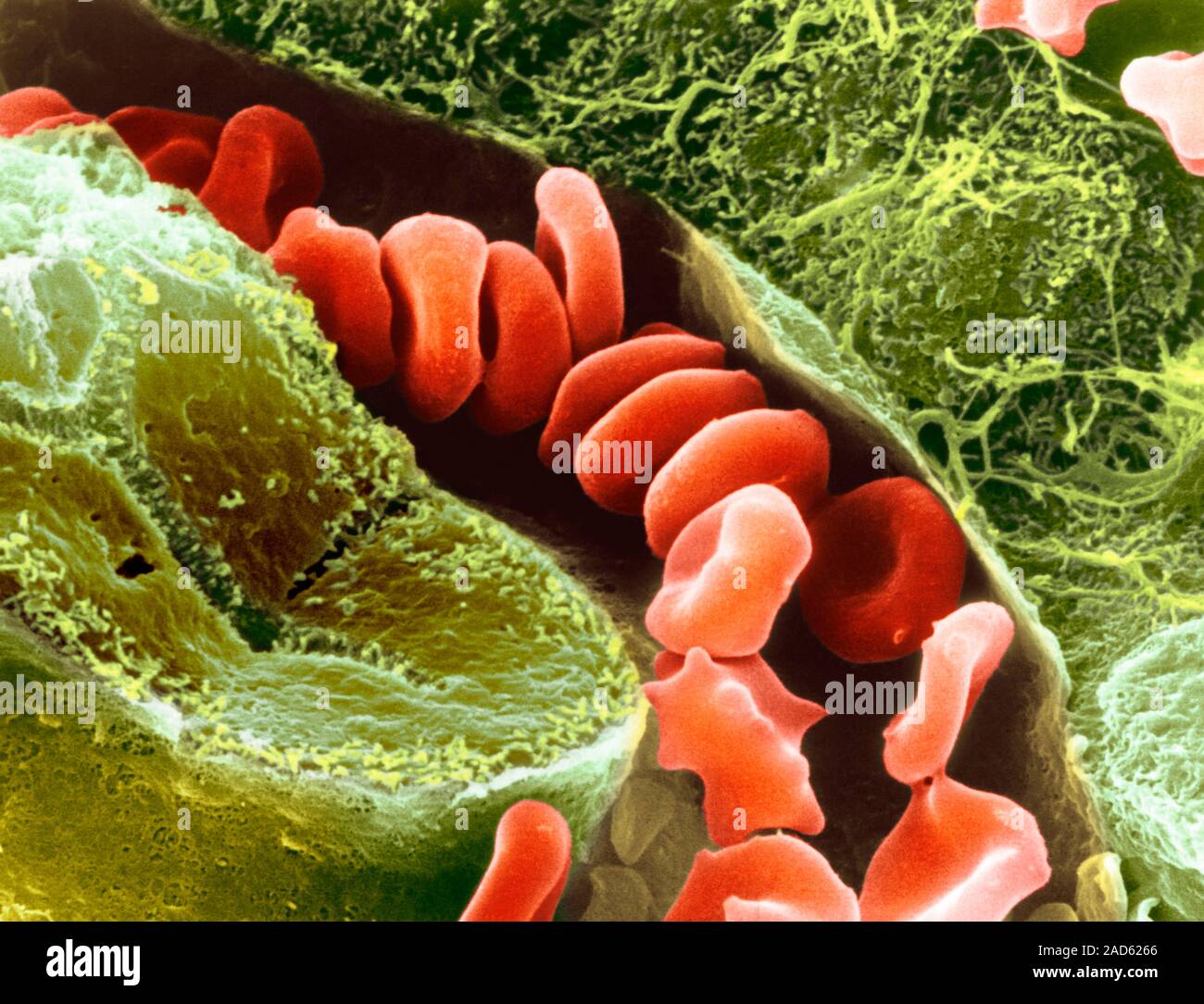 Liver capillary. Coloured scanning electron micrograph (SEM) of a ...