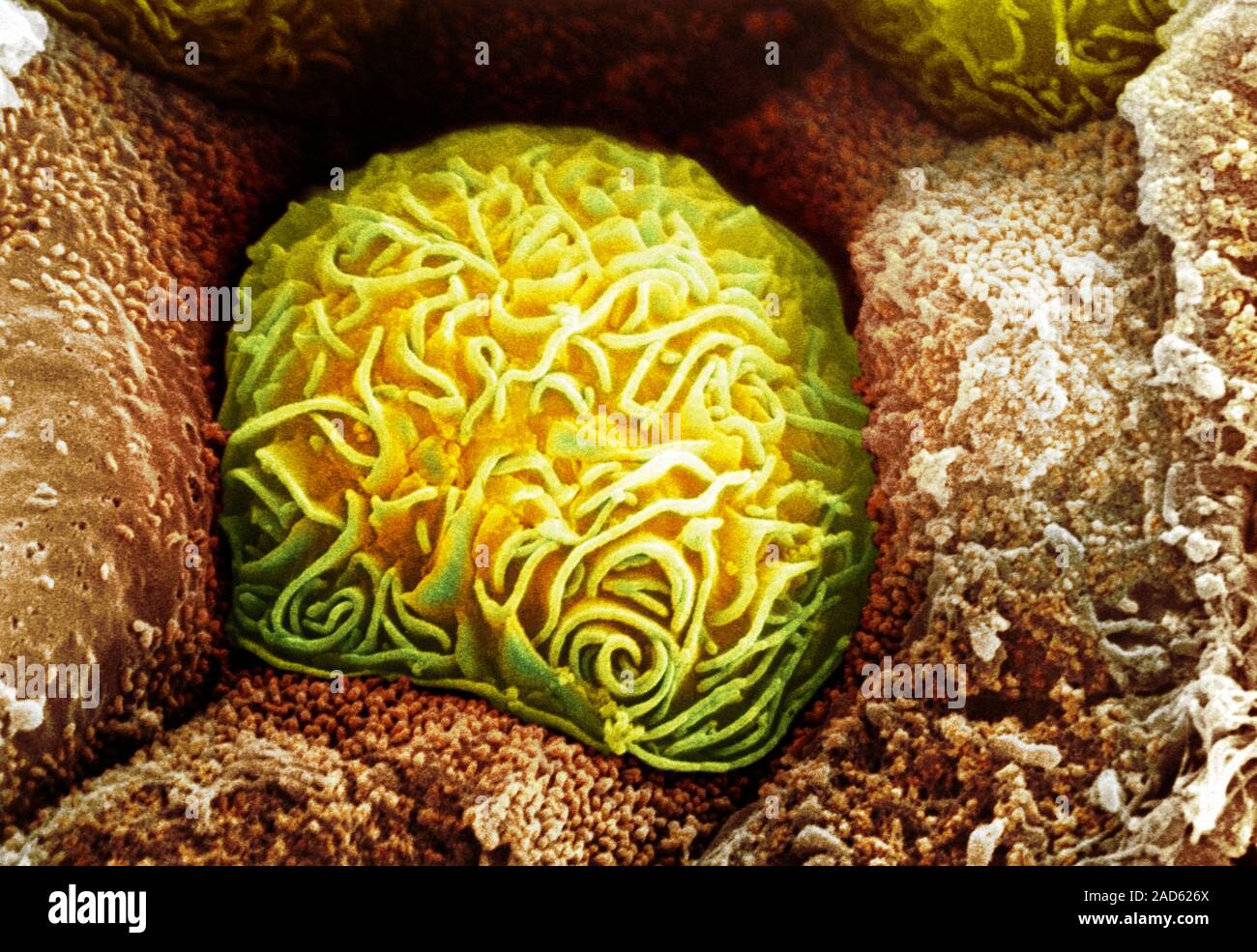 Kidney tubule cell, coloured scanning electron micrograph (SEM). This ...