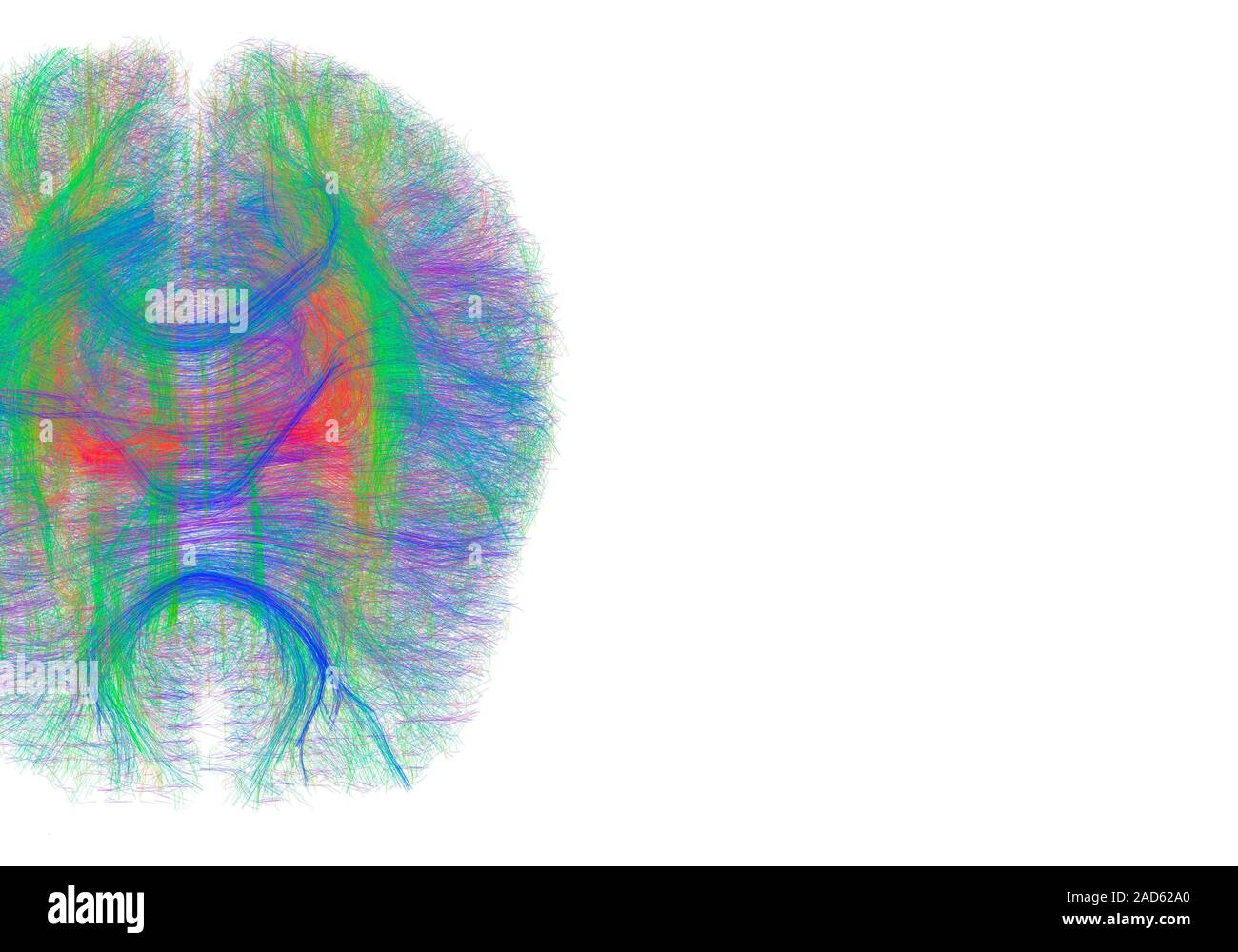 White matter fibres. Coloured 3D diffusion spectral imaging (DSI) scan ...