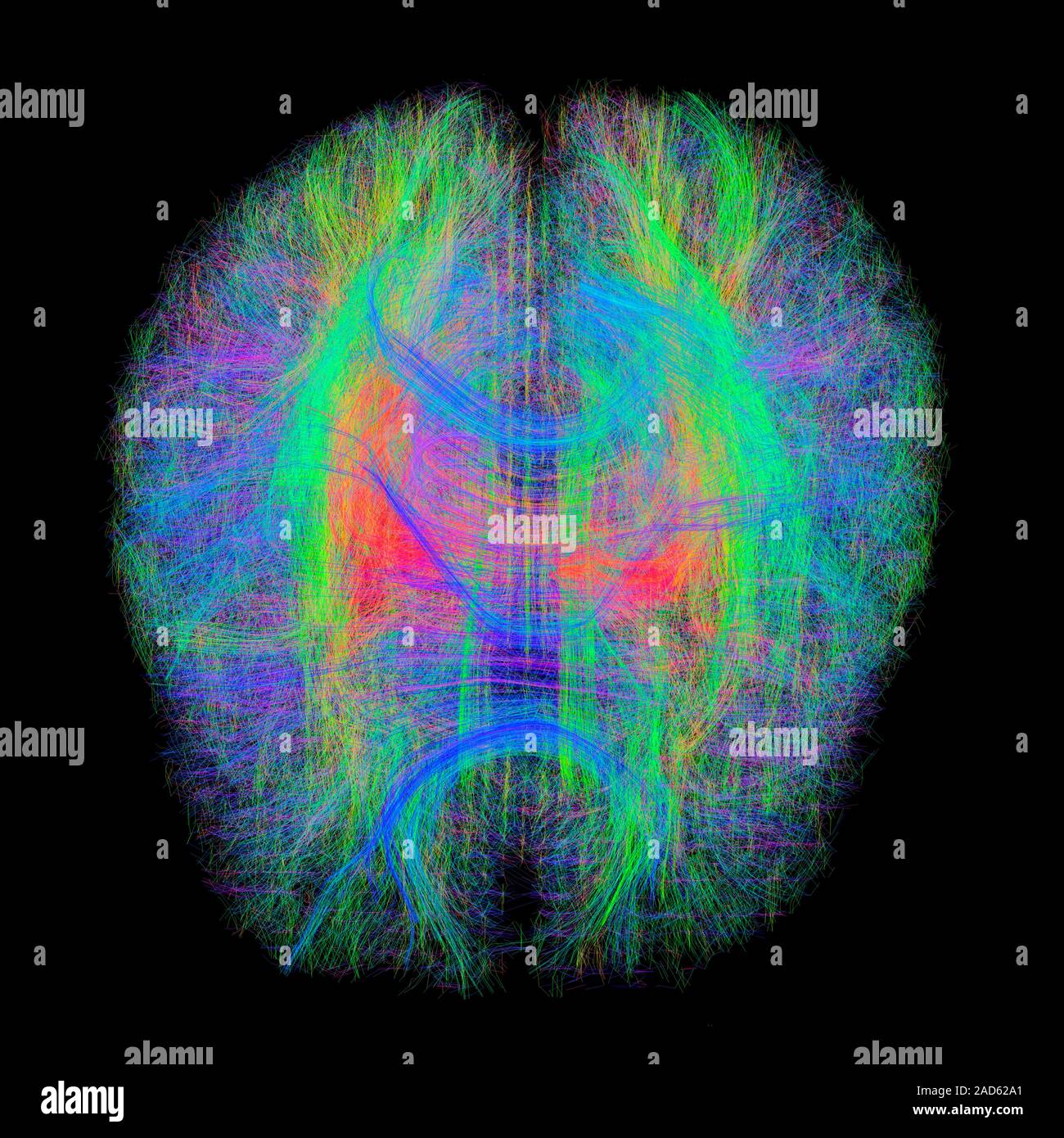 White matter fibres. Coloured 3D diffusion spectral imaging (DSI) scan of the bundles of white ...