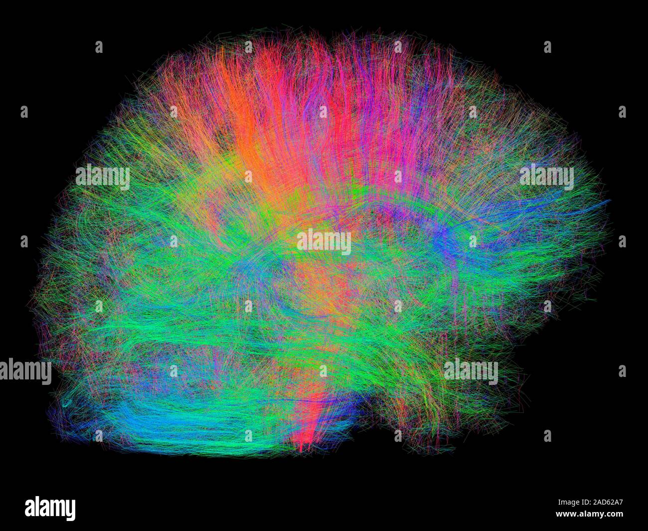 White matter fibres. Coloured 3D diffusion spectral imaging (DSI) scan of the bundles of white ...