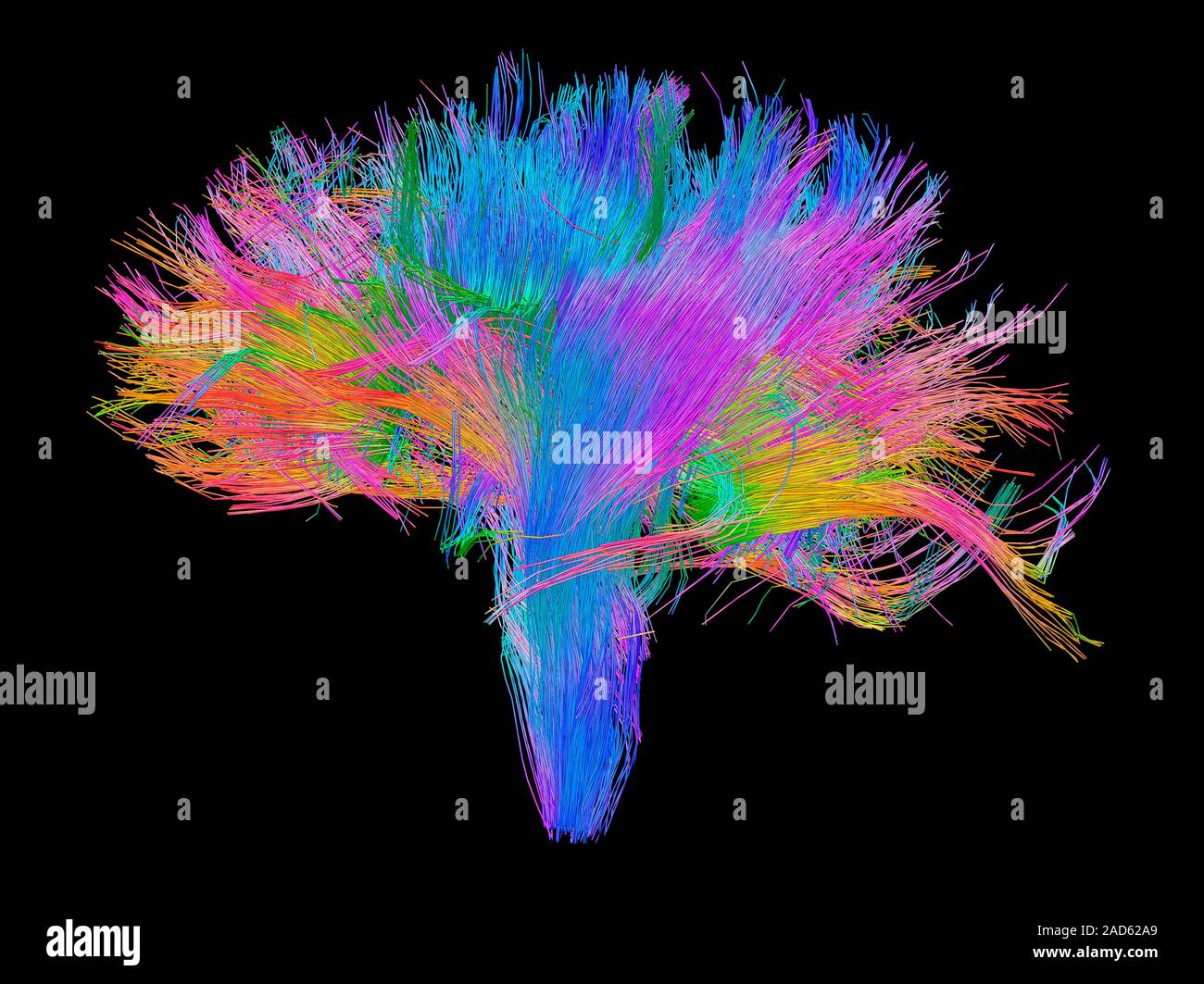 White matter fibres. Coloured 3D diffusion spectral imaging (DSI) scan ...