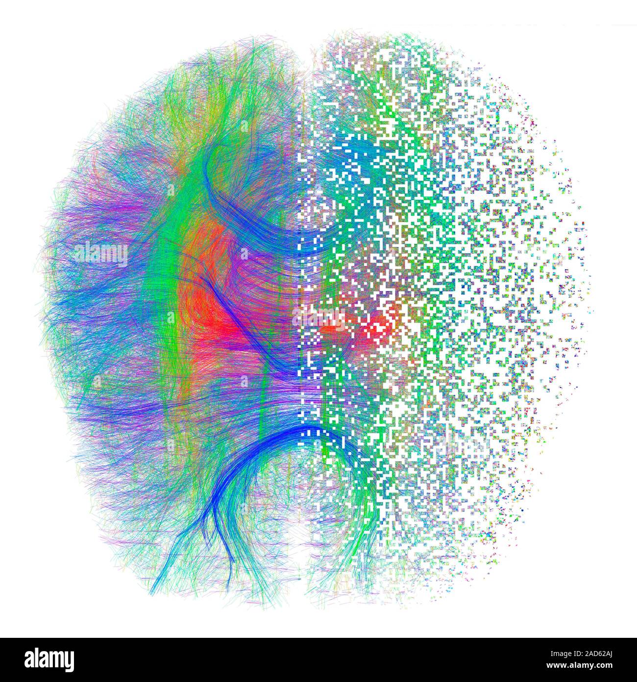 Computer artwort of white matter fibres dissolving on one side ...