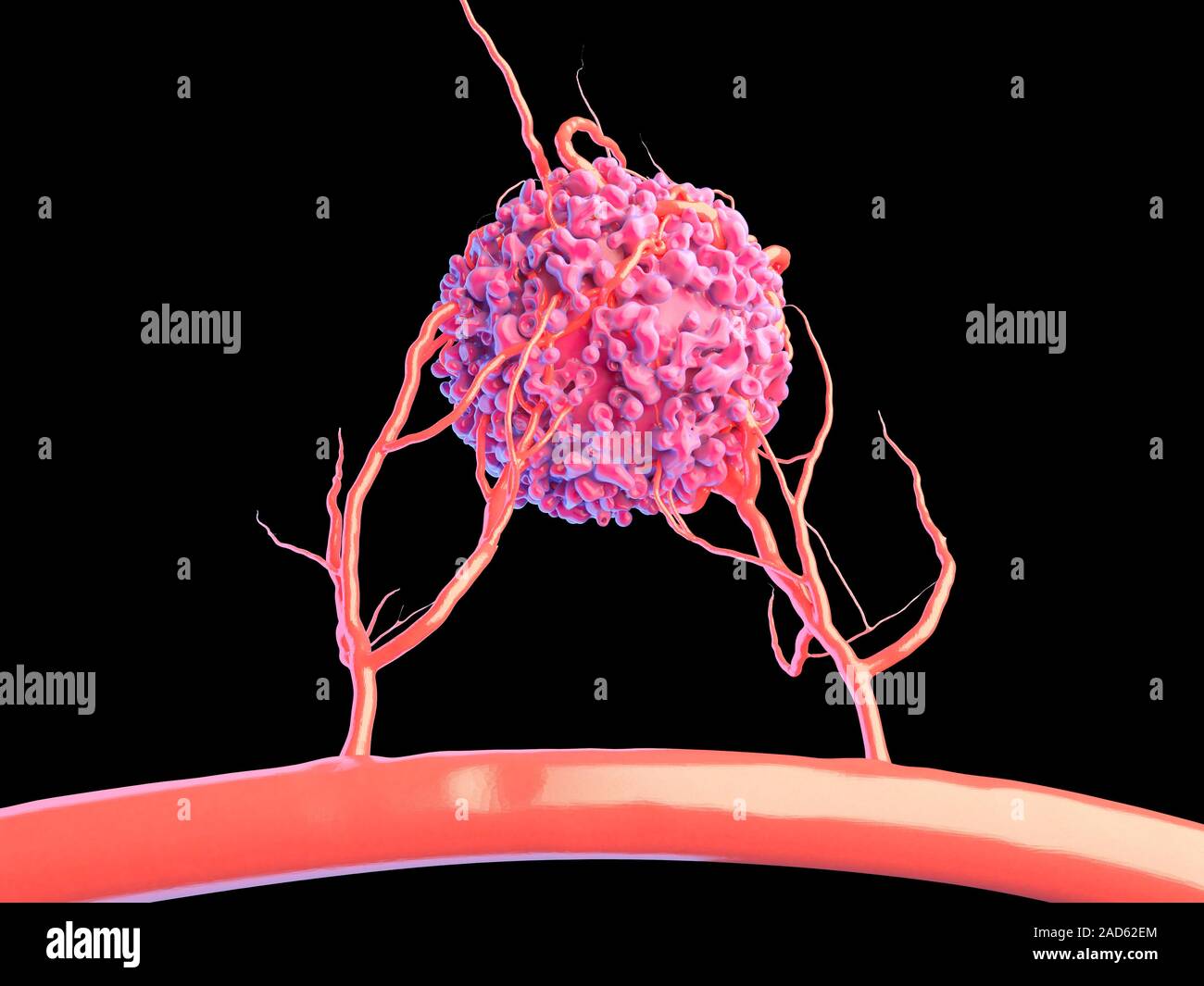 Blood vessel formation. Illustration showing a malignant (cancerous ...