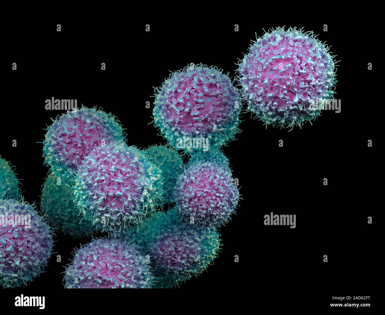 Cancer cells, illustration. Cancerous (malignant) cells divide rapidly ...