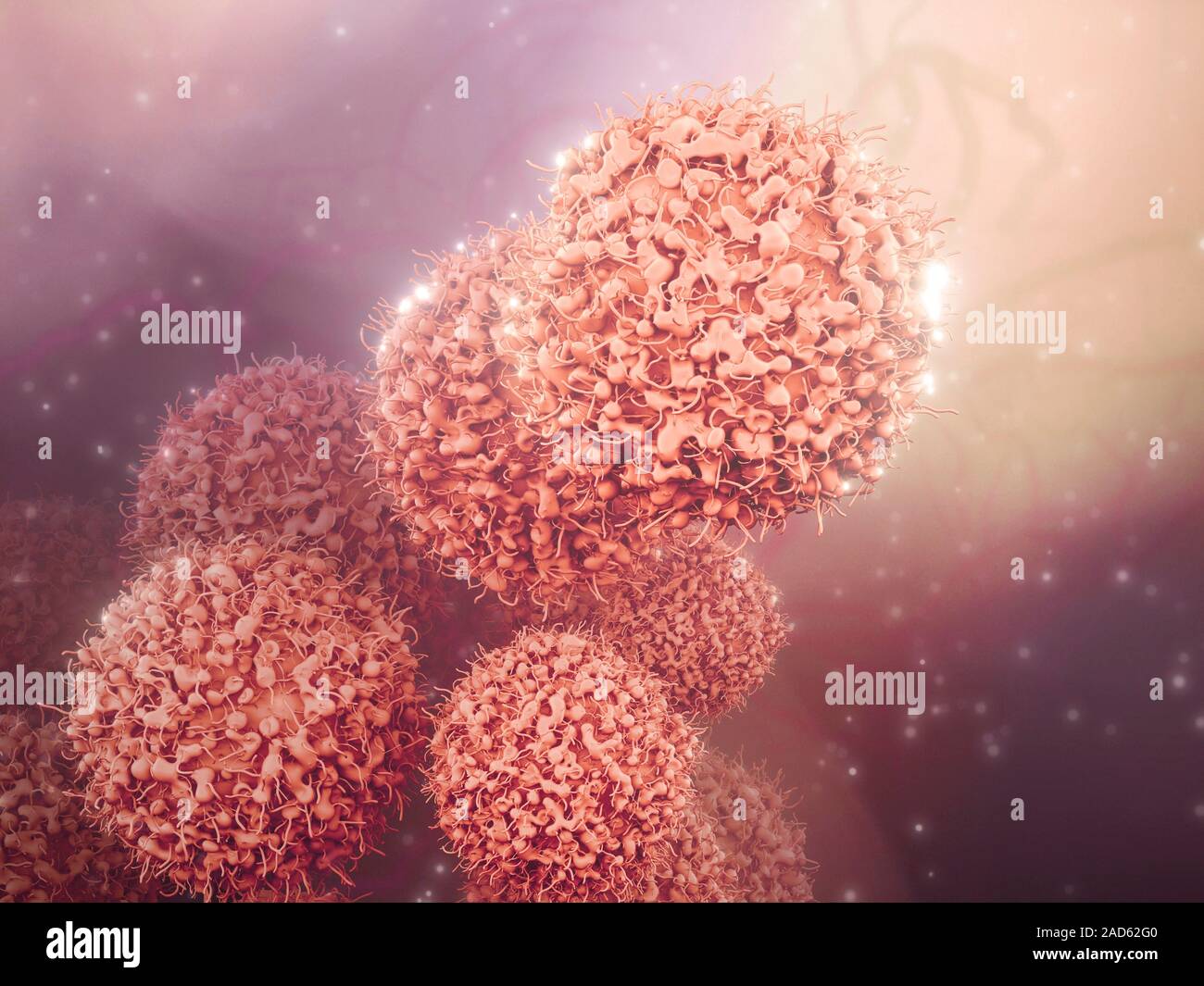Cancer cells, illustration. Cancerous (malignant) cells divide rapidly ...