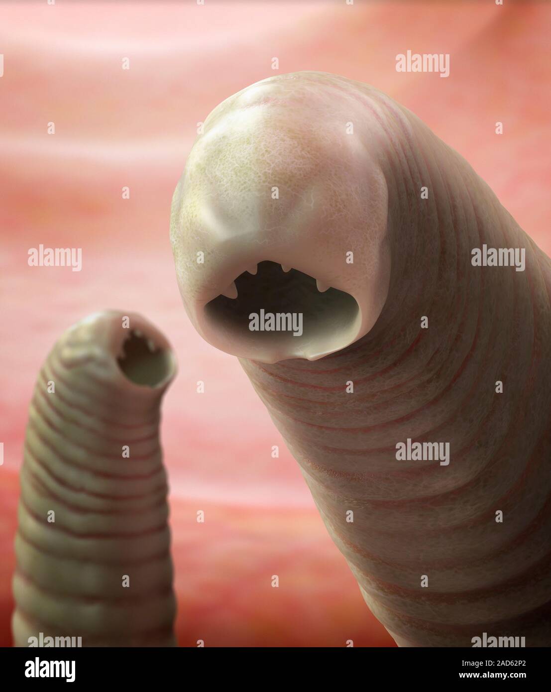 Hookworms. Illustration of the heads of two hookworms, showing the oral ...